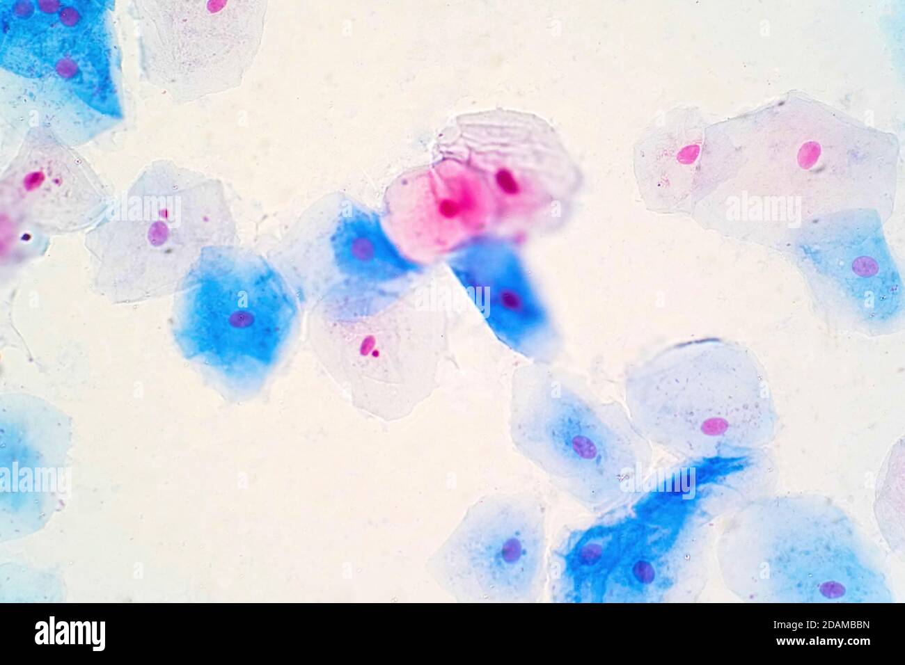 Cellula epiteliale squamosa immagini e fotografie stock ad alta ...