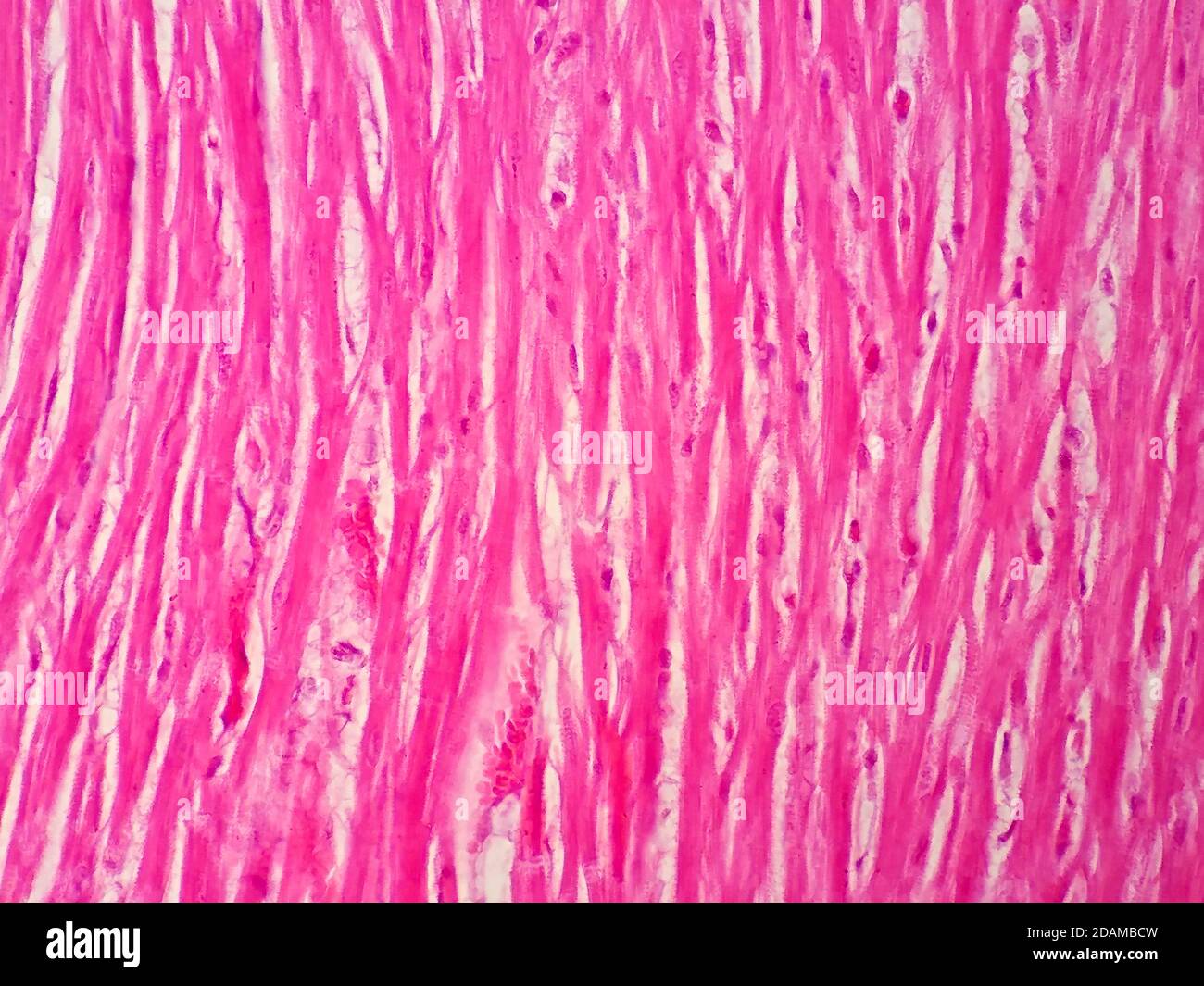 Muscolo cardiaco umano, micrografia leggera. Il muscolo cardiaco è uno ...