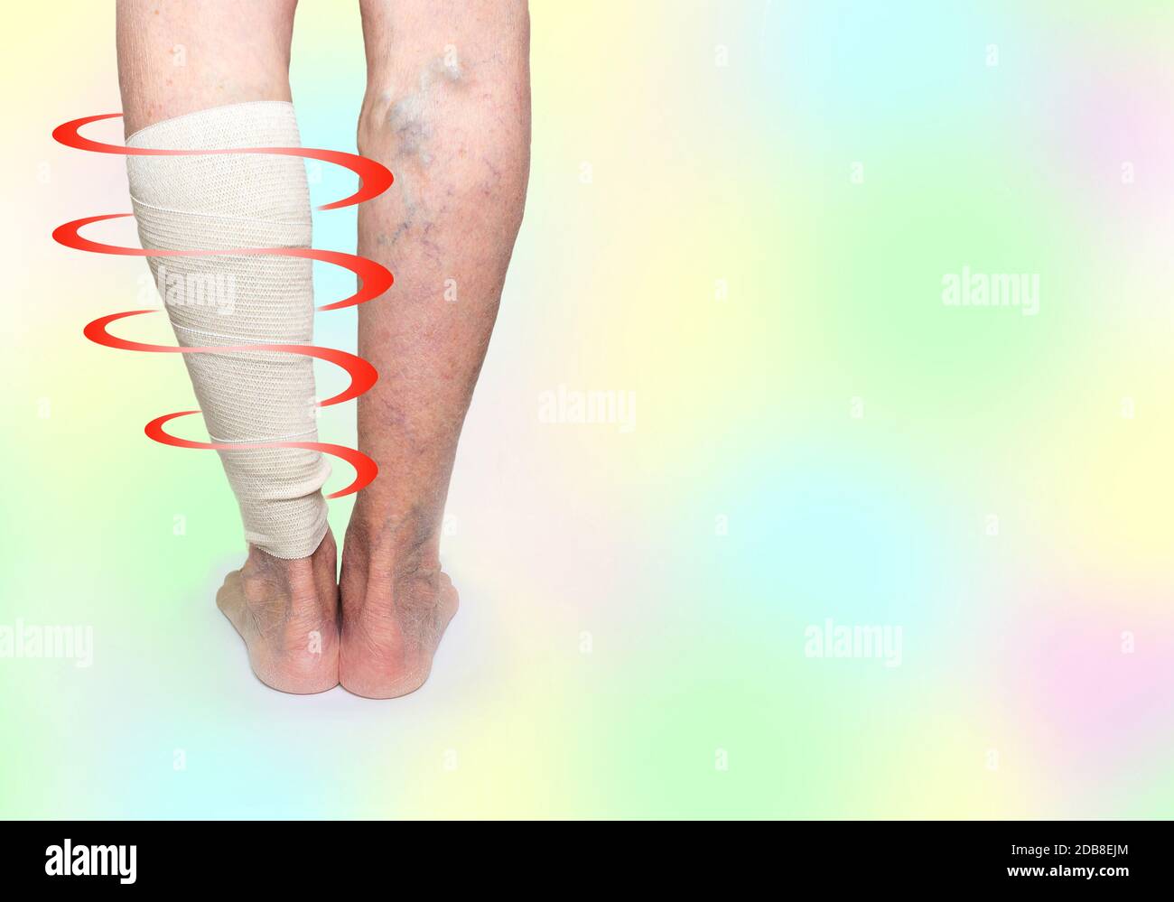 Vene arterie gambe immagini e fotografie stock ad alta risoluzione - Alamy