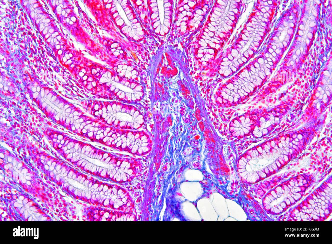 Epitelio intestinale immagini e fotografie stock ad alta risoluzione ...