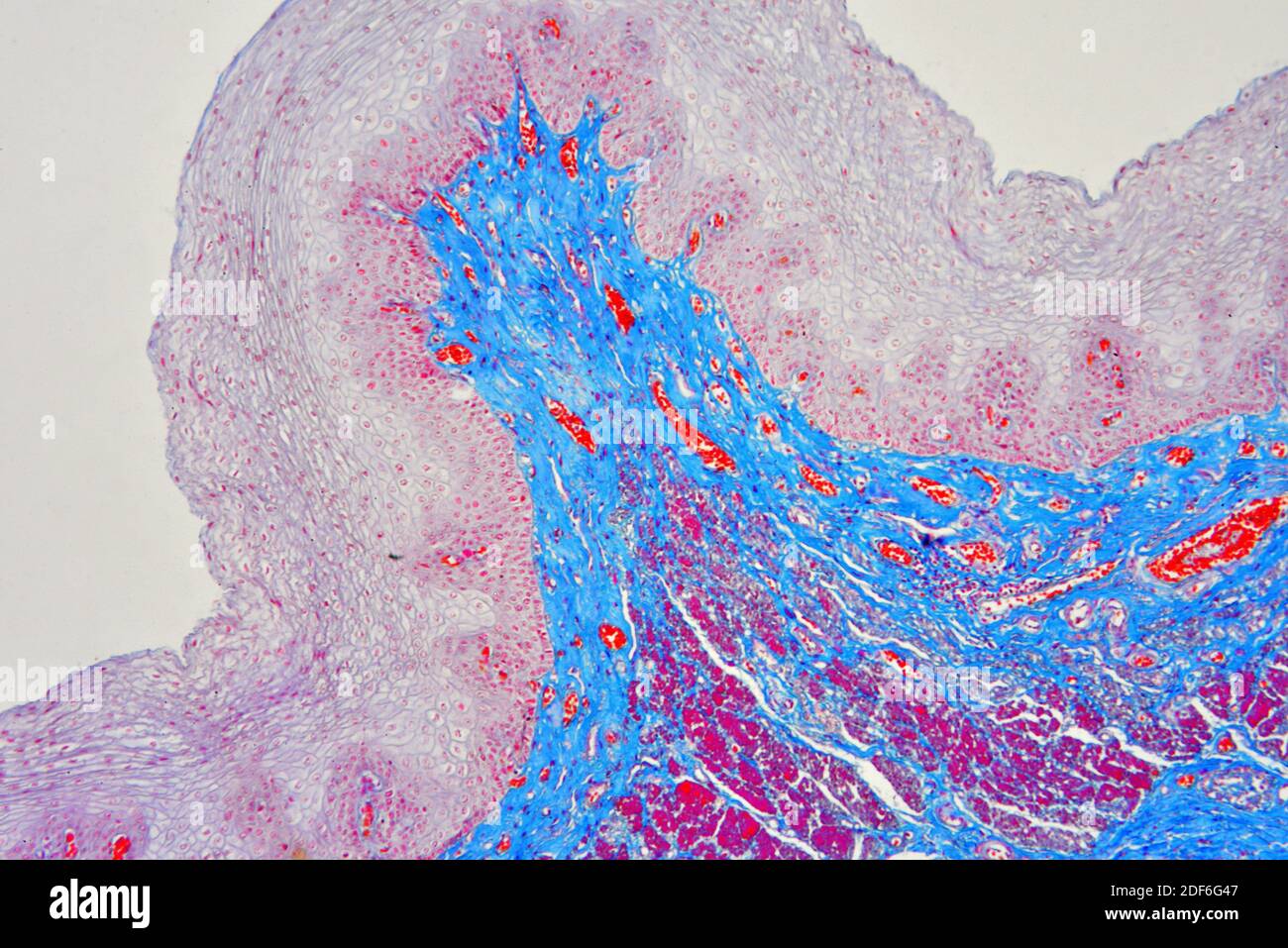Stratified squamous epithelium immagini e fotografie stock ad alta ...