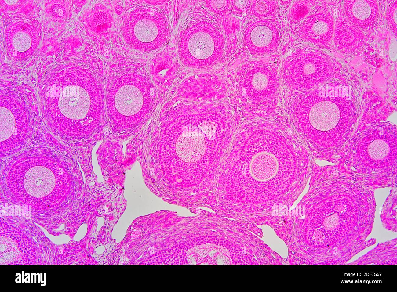 Ovarian follicle histology immagini e fotografie stock ad alta ...