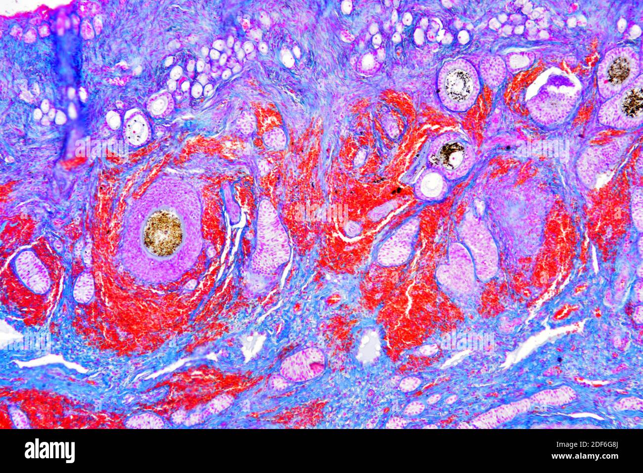 Ovarian follicle histology immagini e fotografie stock ad alta ...