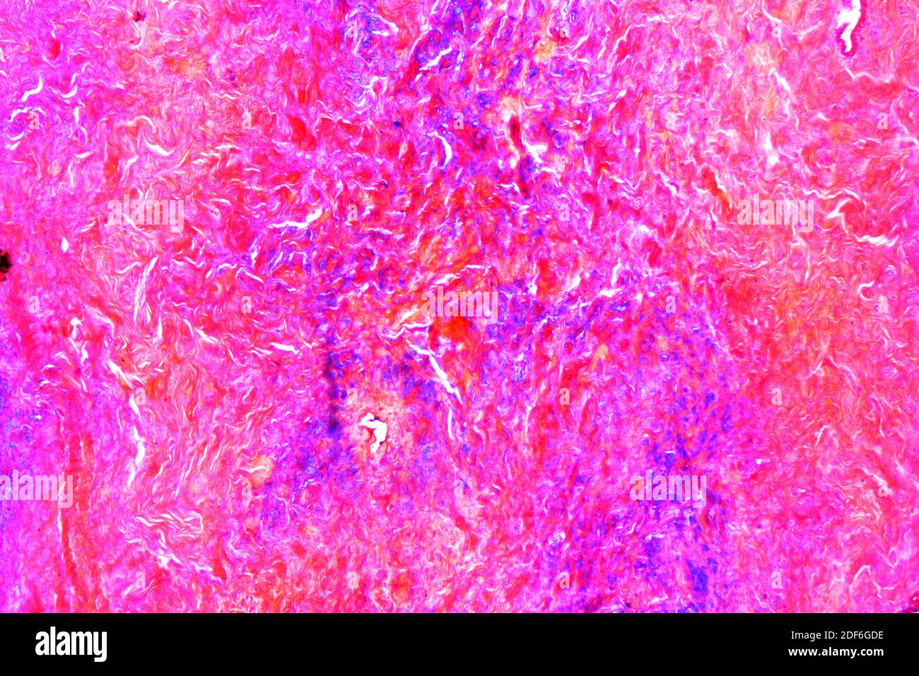 Connective tissue with collagen fibers immagini e fotografie stock ad ...
