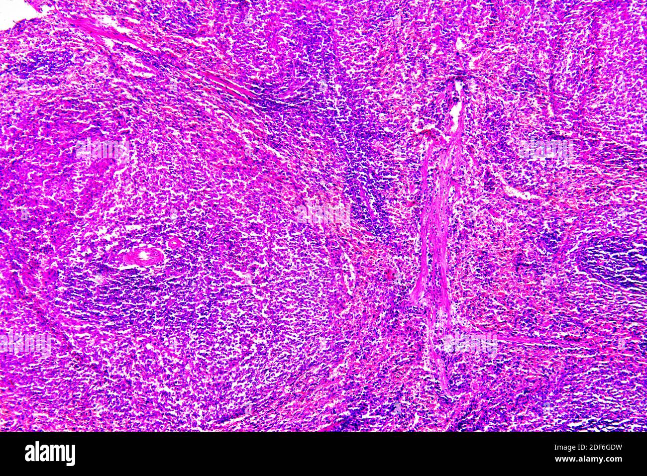 Uso normale immagini e fotografie stock ad alta risoluzione - Alamy