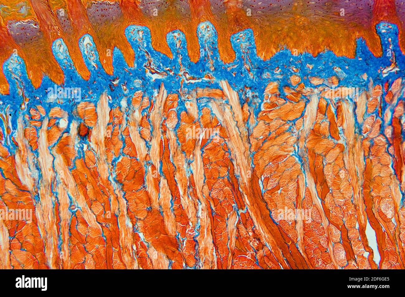 Tongue papilla immagini e fotografie stock ad alta risoluzione - Alamy