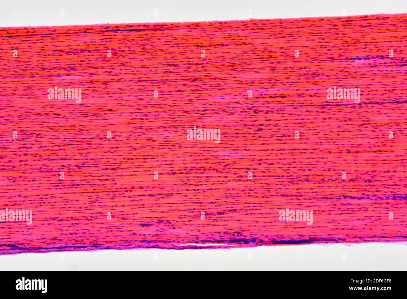 Tessuto connettivo fibroso immagini e fotografie stock ad alta ...