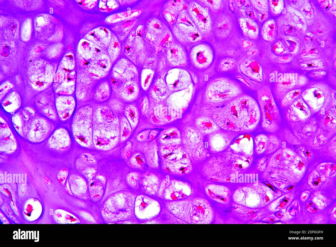 Bone matrix immagini e fotografie stock ad alta risoluzione - Alamy