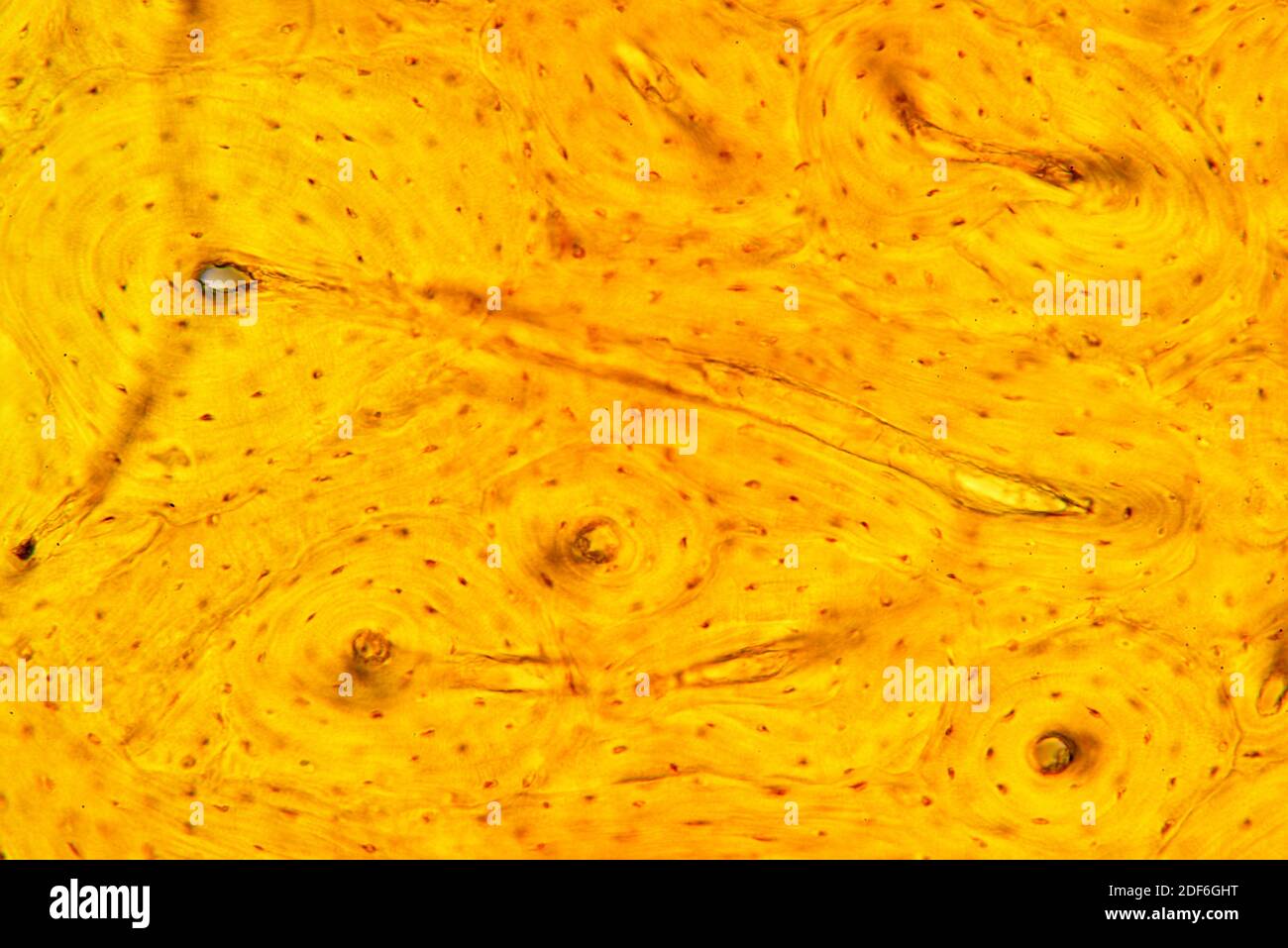 Istologia osso corticale immagini e fotografie stock ad alta ...