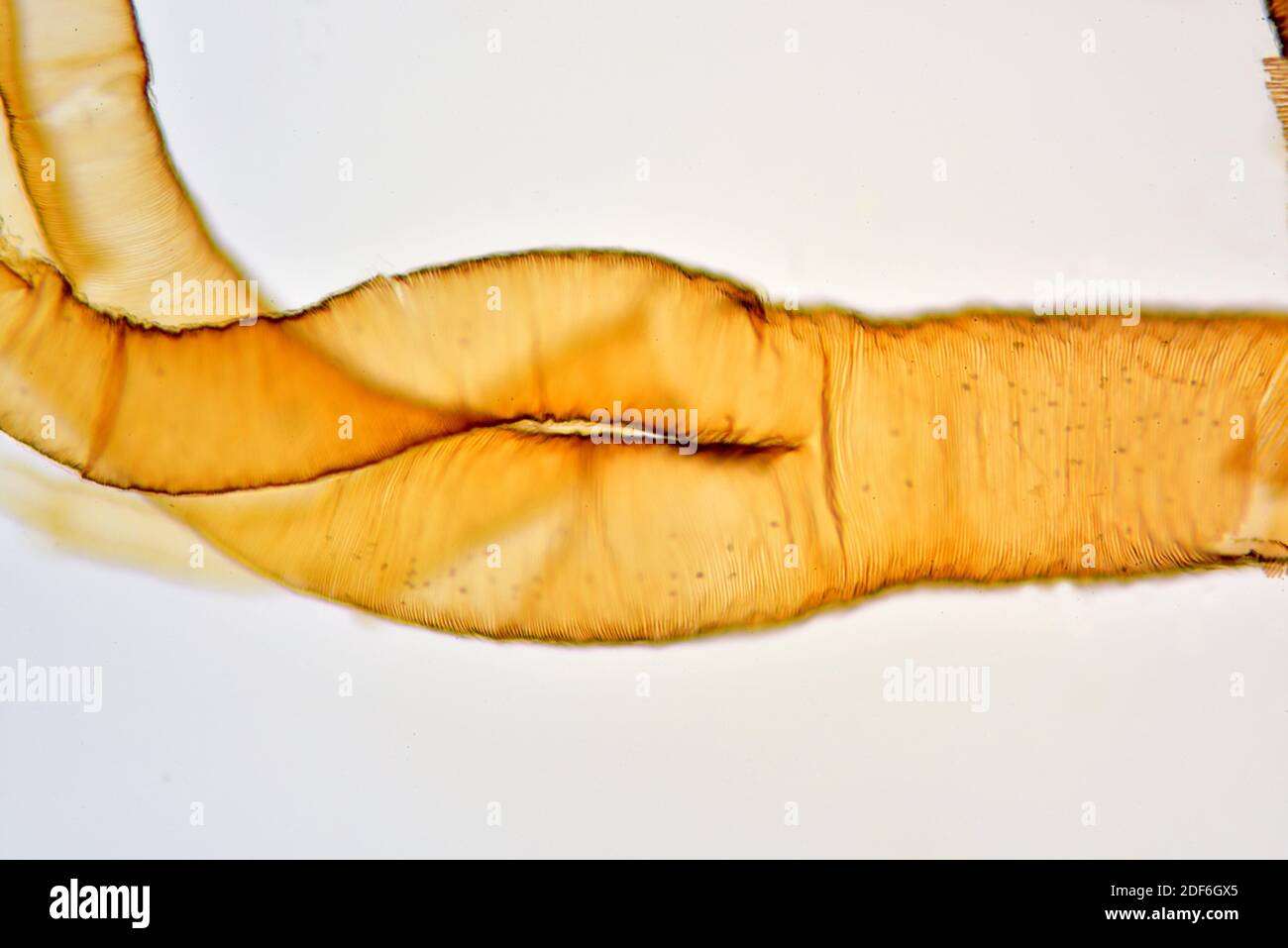 Apparato respiratorio trachea immagini e fotografie stock ad alta ...
