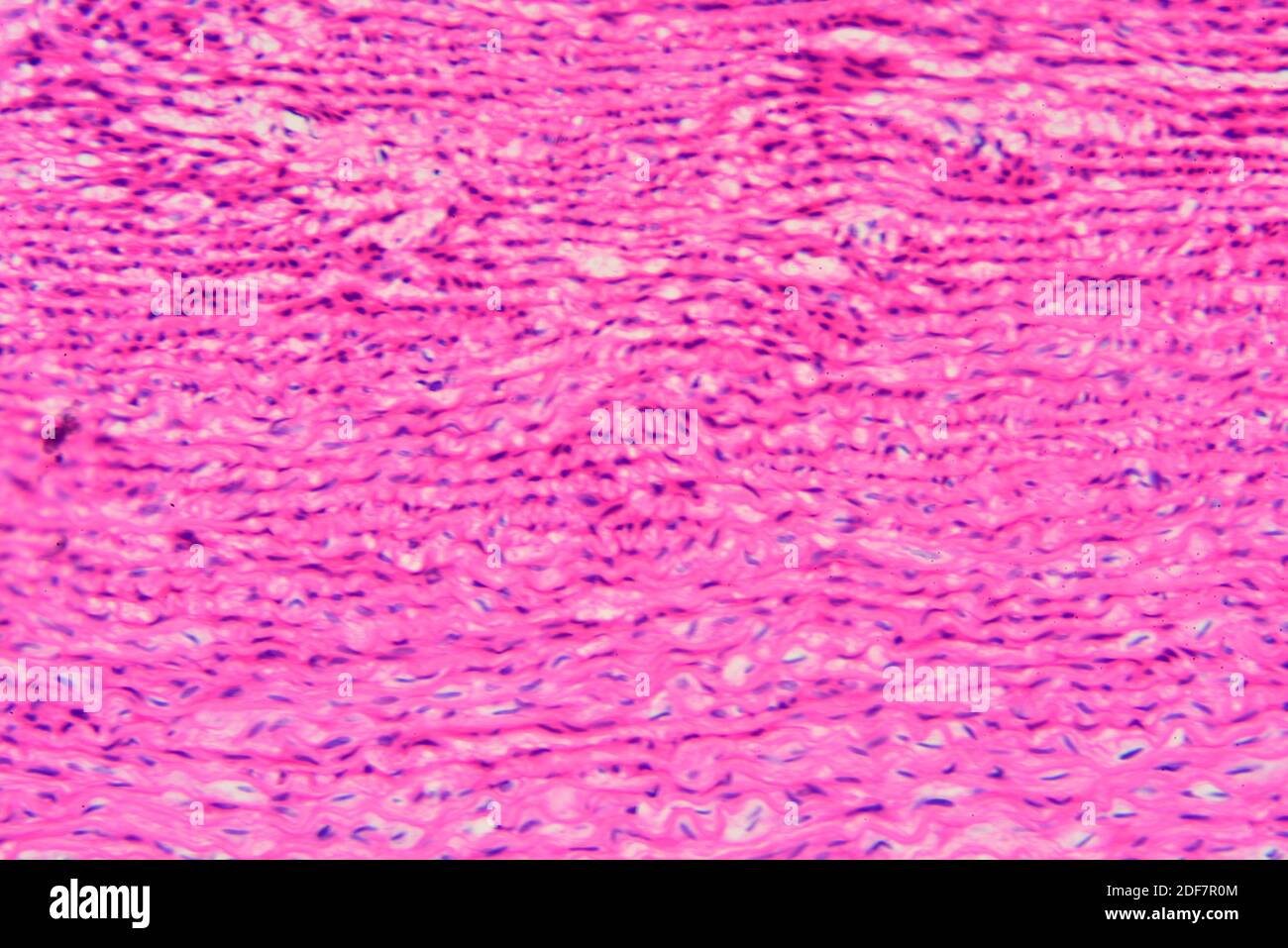 Fibre muscolari immagini e fotografie stock ad alta risoluzione - Alamy