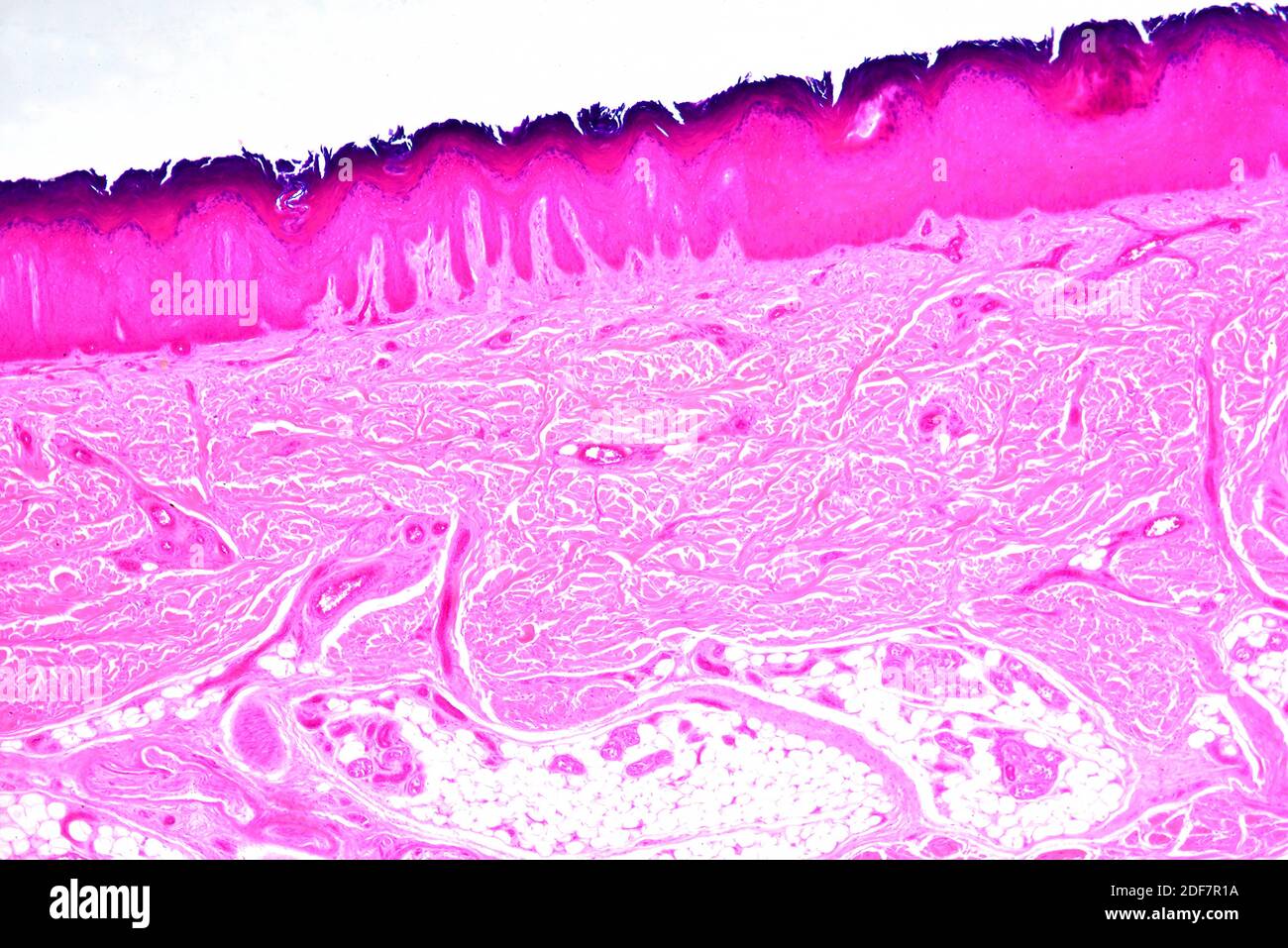 Skin tissue immagini e fotografie stock ad alta risoluzione - Alamy