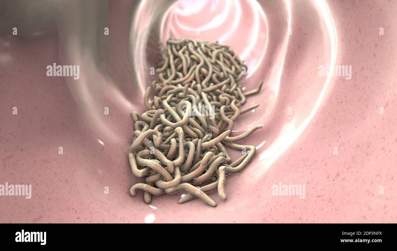 Nematode nematode enterobio immagini e fotografie stock ad alta ...