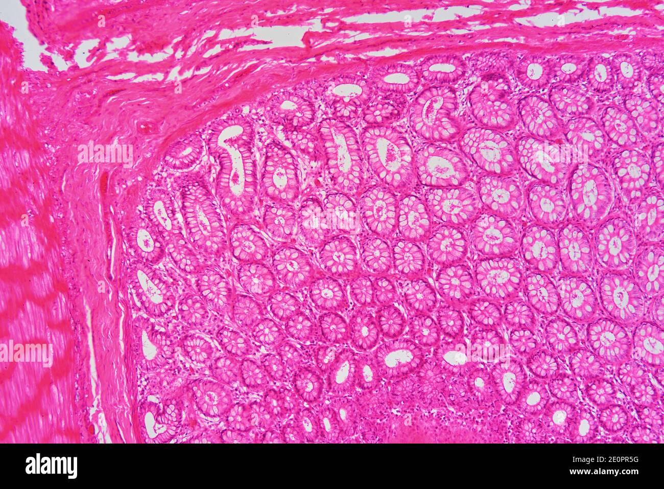 Mucosa of the colon immagini e fotografie stock ad alta risoluzione - Alamy