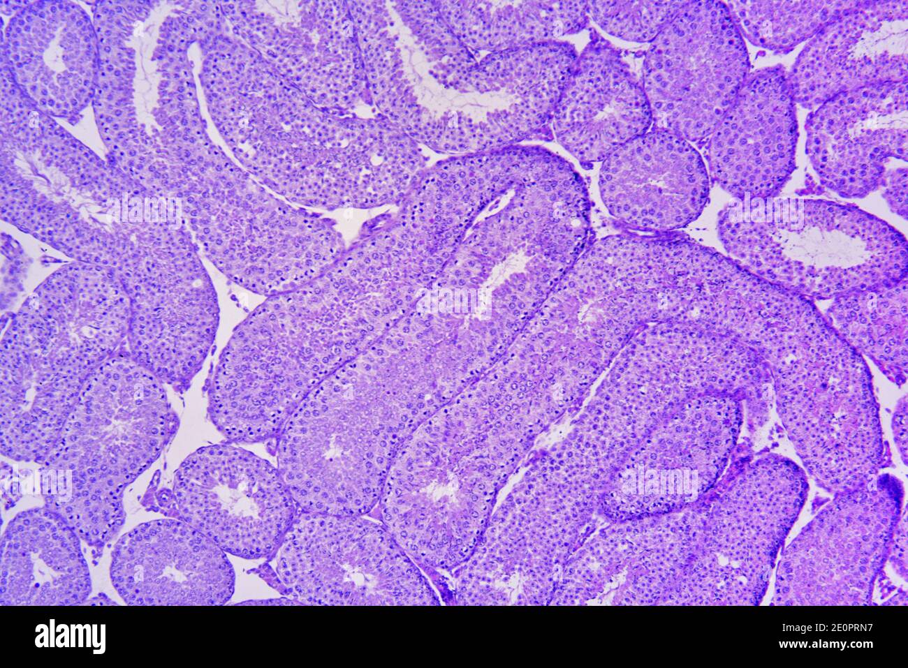 Seminal vesicle immagini e fotografie stock ad alta risoluzione - Alamy