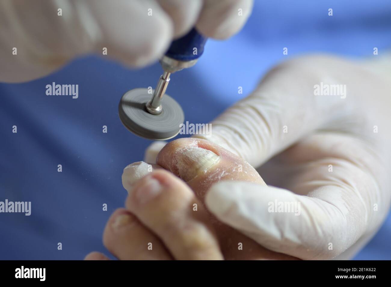 Dita dei piedi solletico immagini e fotografie stock ad alta ...