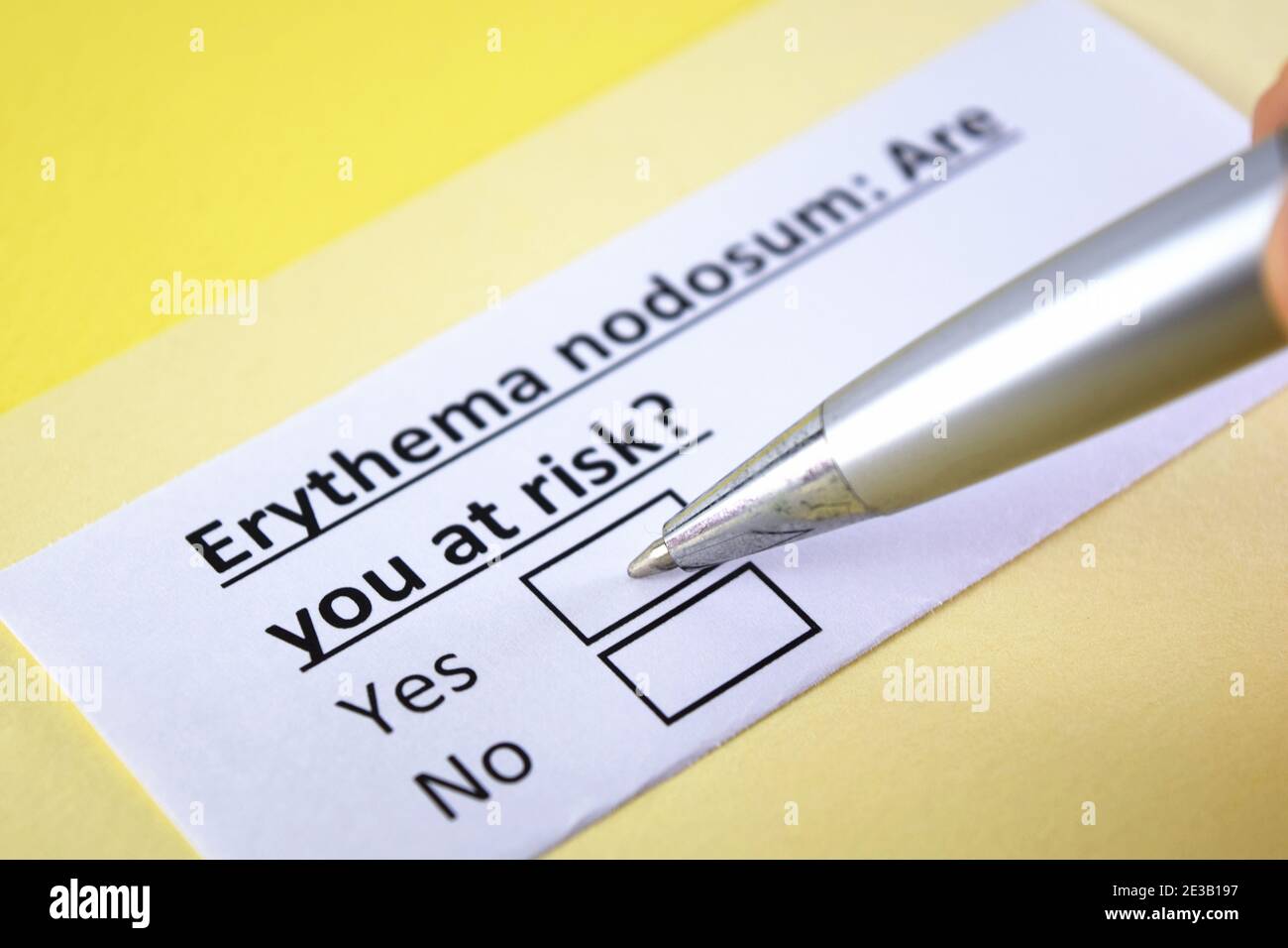 Erythema nodosum immagini e fotografie stock ad alta risoluzione - Alamy