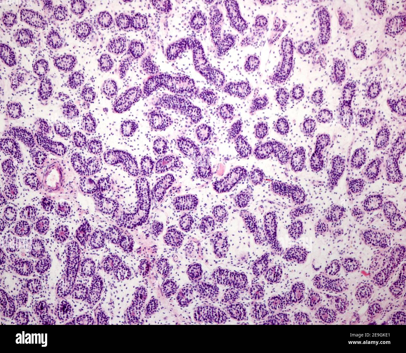 Cellule germinali maschili immagini e fotografie stock ad alta ...