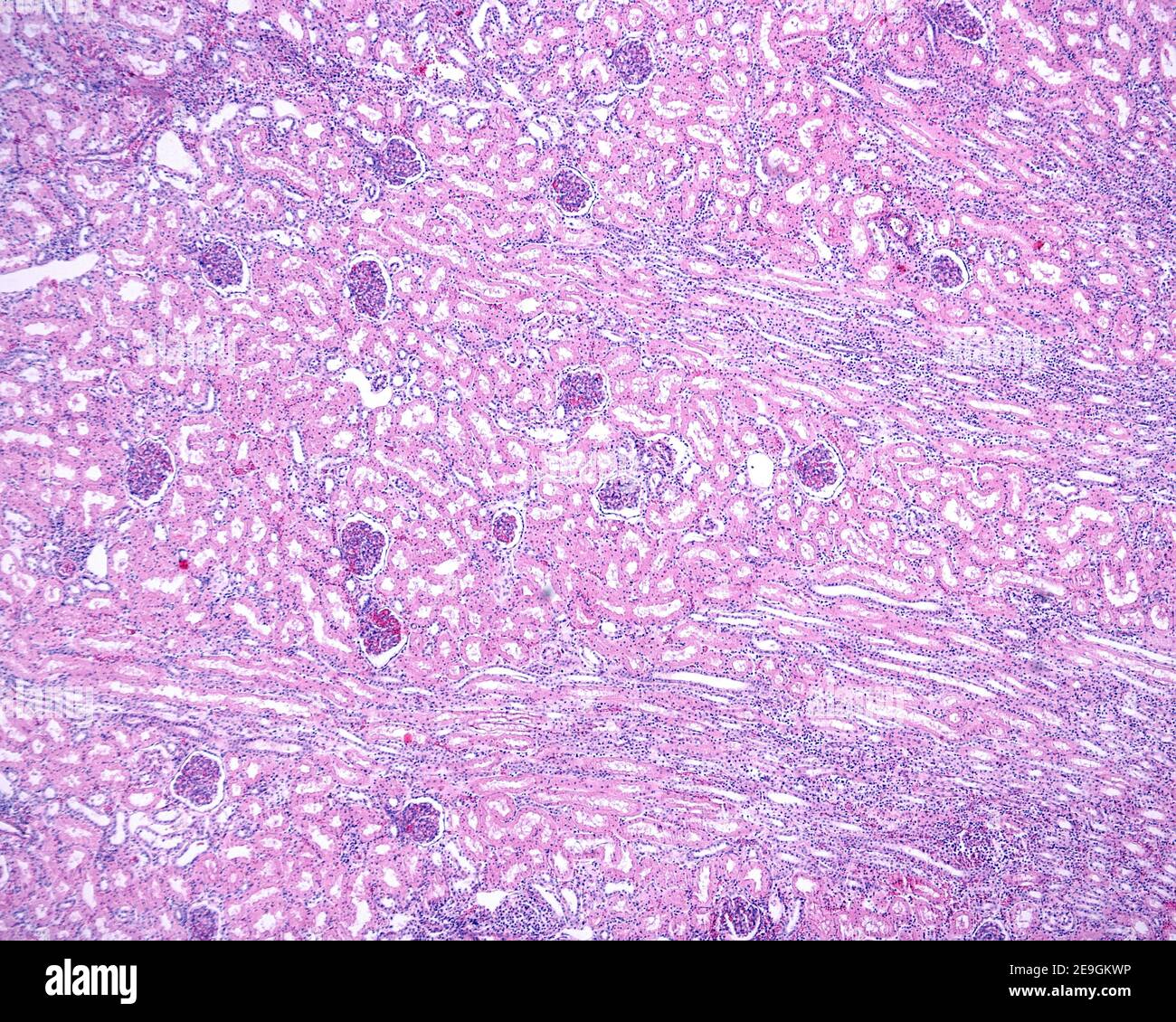 Tessuto epiteliale rene microscopio immagini e fotografie stock ad alta ...