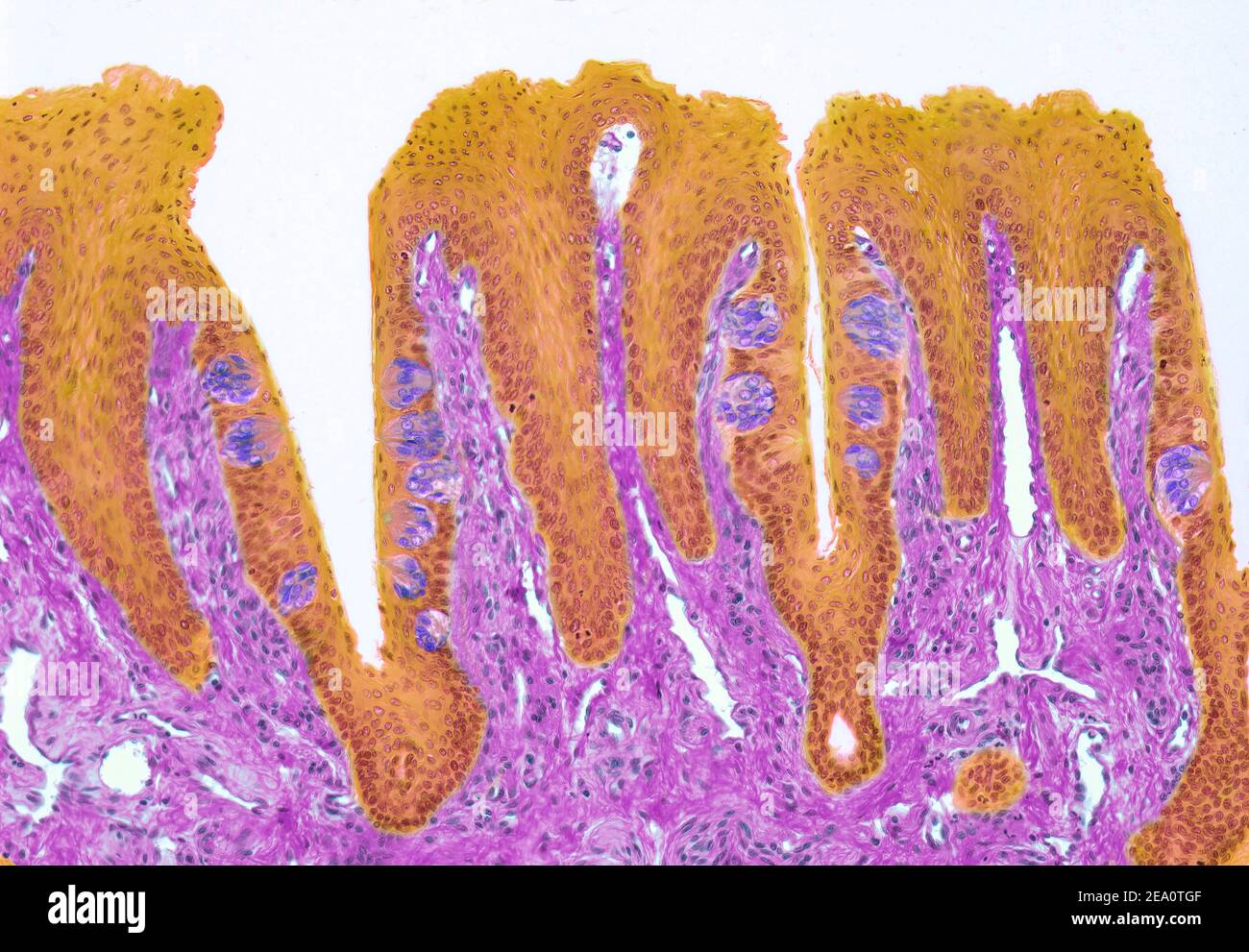 Anatomia delle papille gustative immagini e fotografie stock ad alta ...
