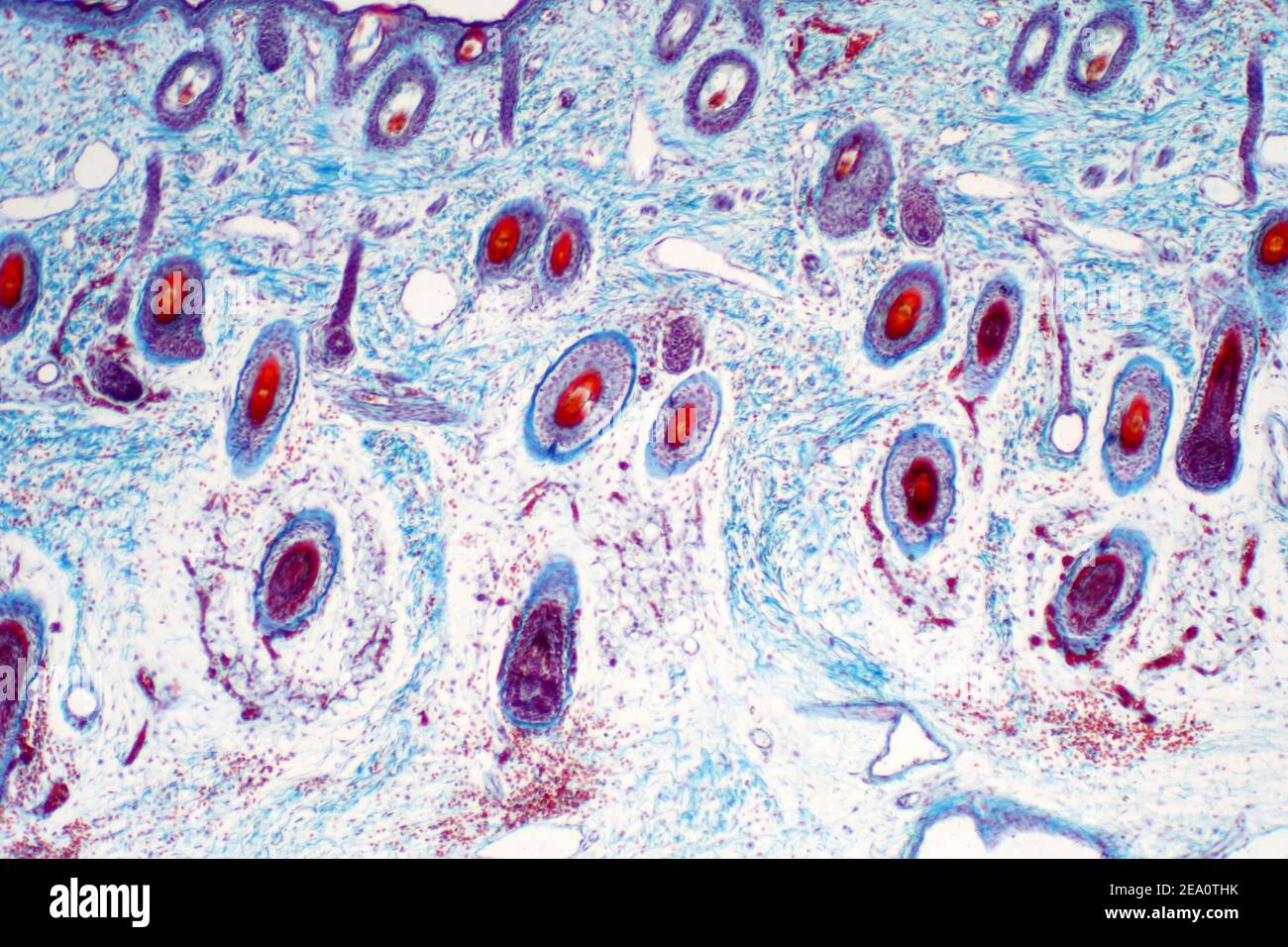 Micrografia leggera immagini e fotografie stock ad alta risoluzione - Alamy