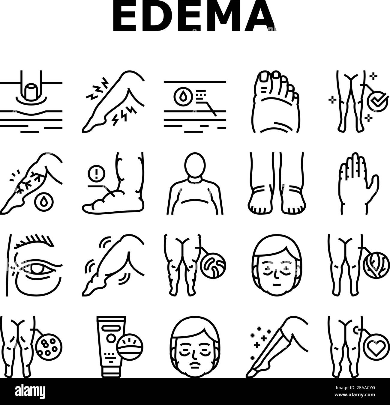 Edema alle gambe Foto e Immagini Stock in Bianco e Nero - Alamy