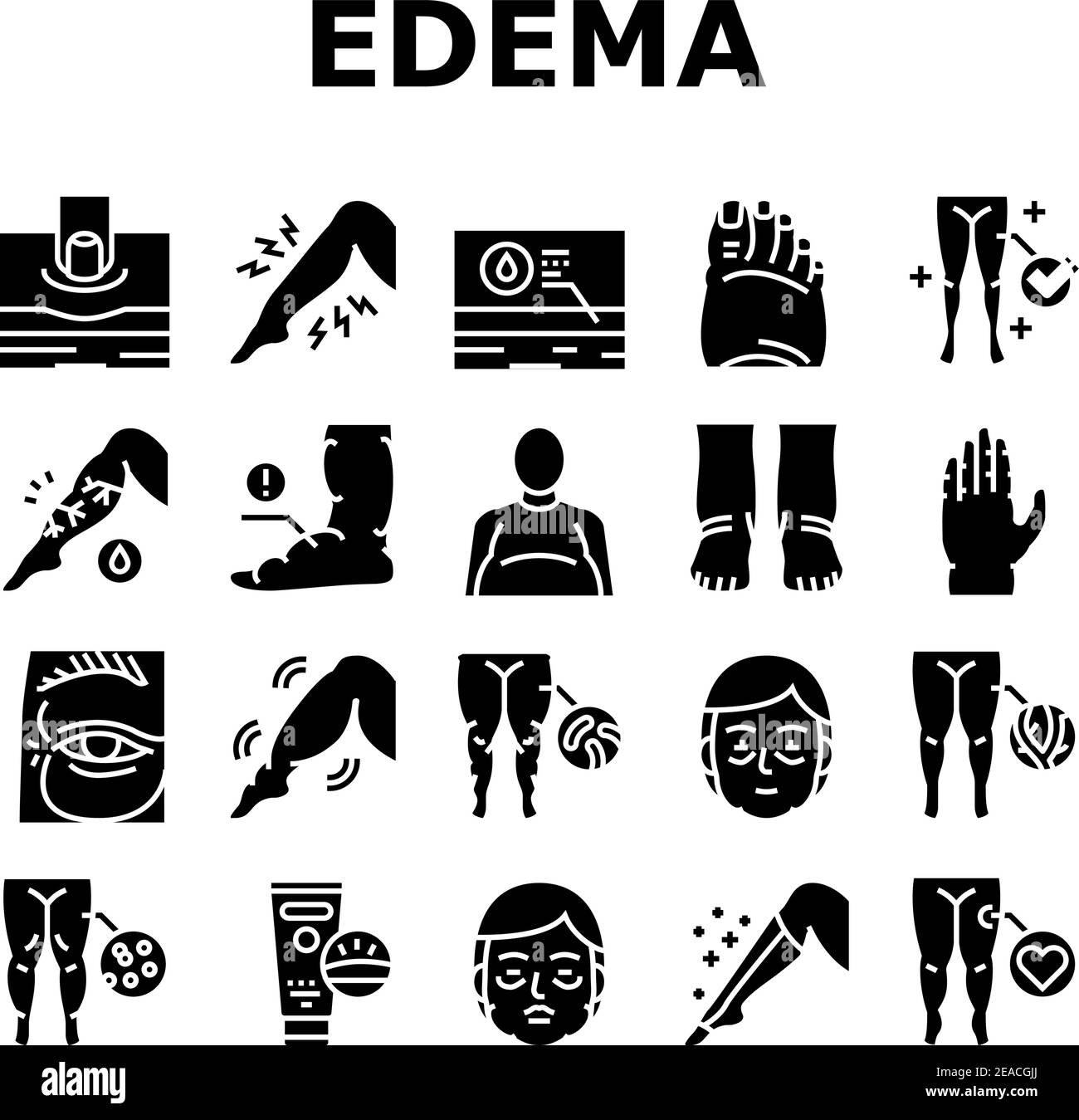 Edema alle gambe Foto e Immagini Stock in Bianco e Nero - Alamy