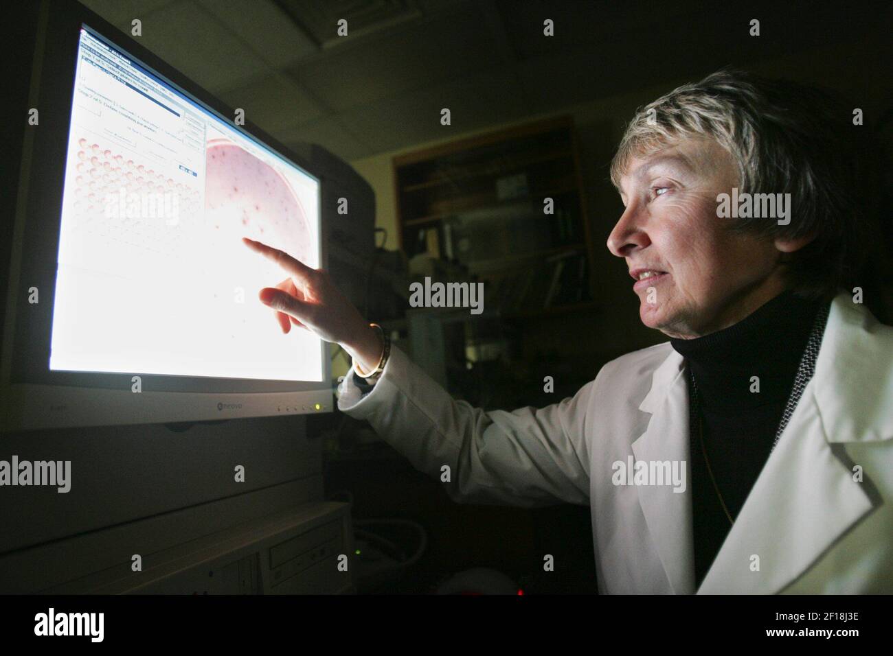 KRT US NOTIZIE STORIA SLUGGED: MED-VIRUSCOUPLE KRT FOTO DA LEW STAMP ...