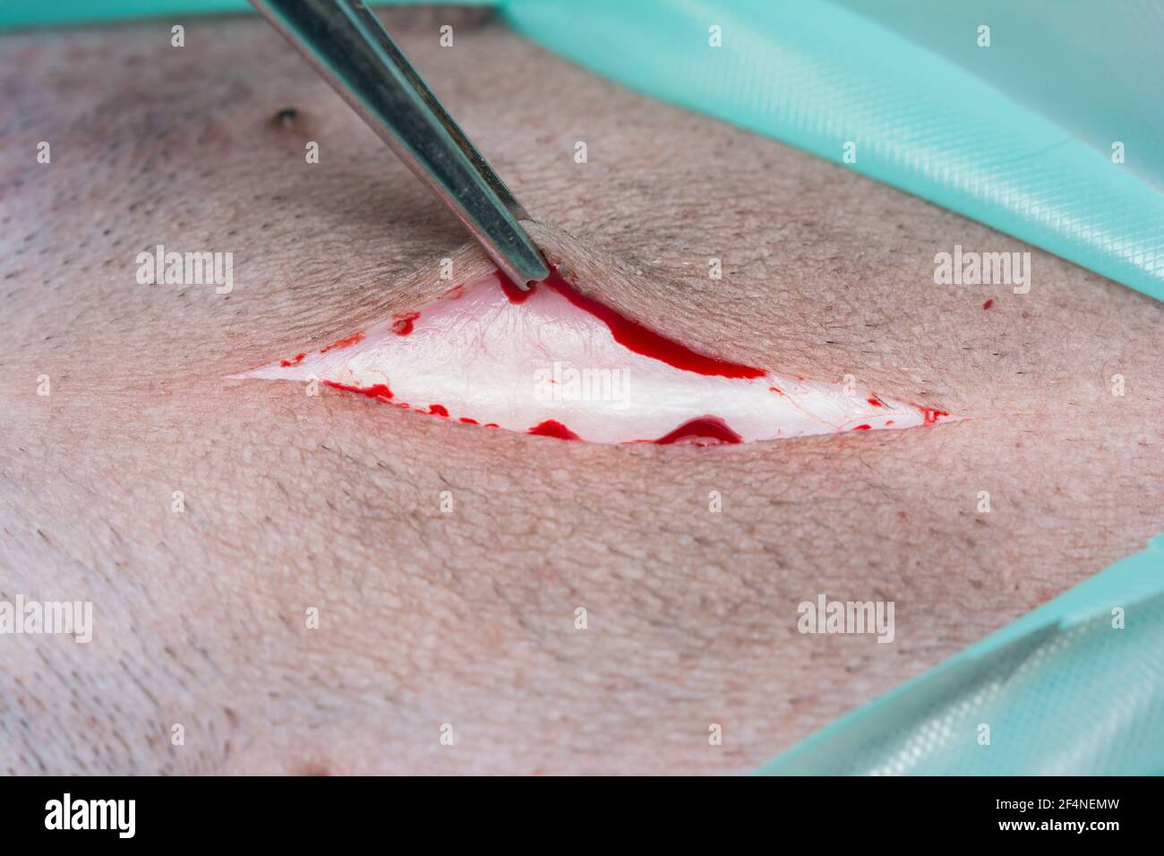 Linea alba immagini e fotografie stock ad alta risoluzione - Alamy