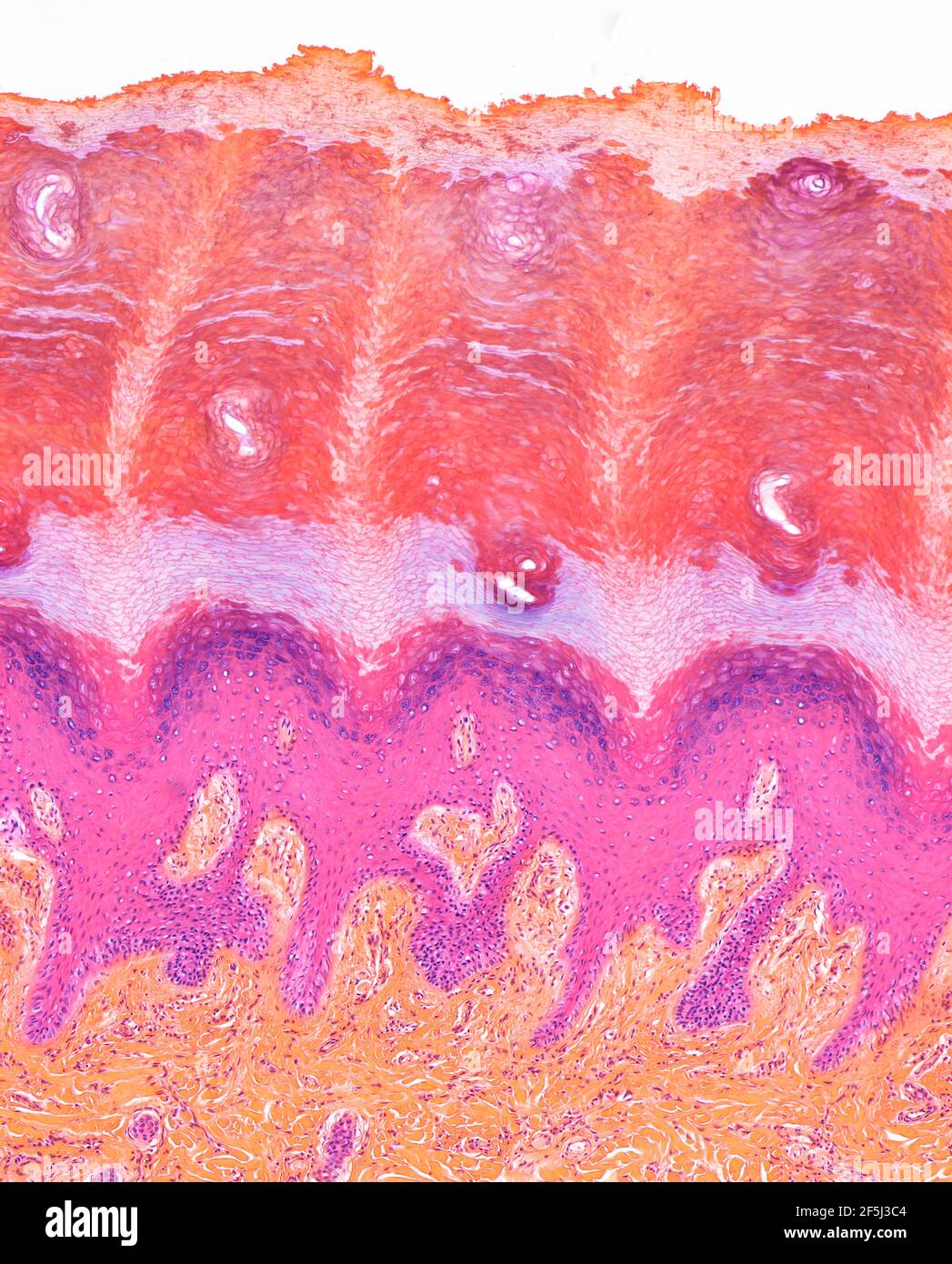 Pelle umana microscopio immagini e fotografie stock ad alta risoluzione ...