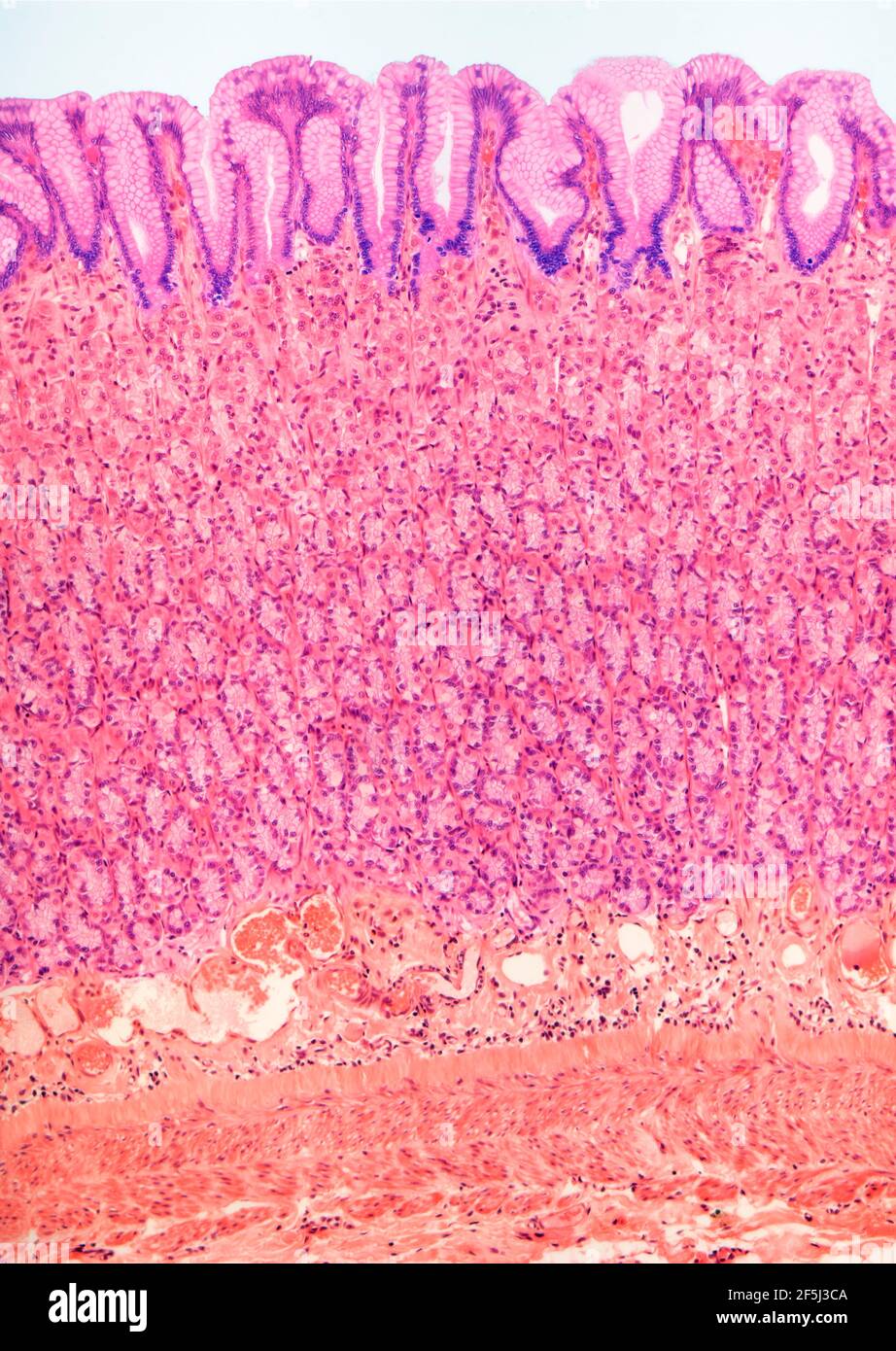 Mucosa dello stomaco immagini e fotografie stock ad alta risoluzione ...