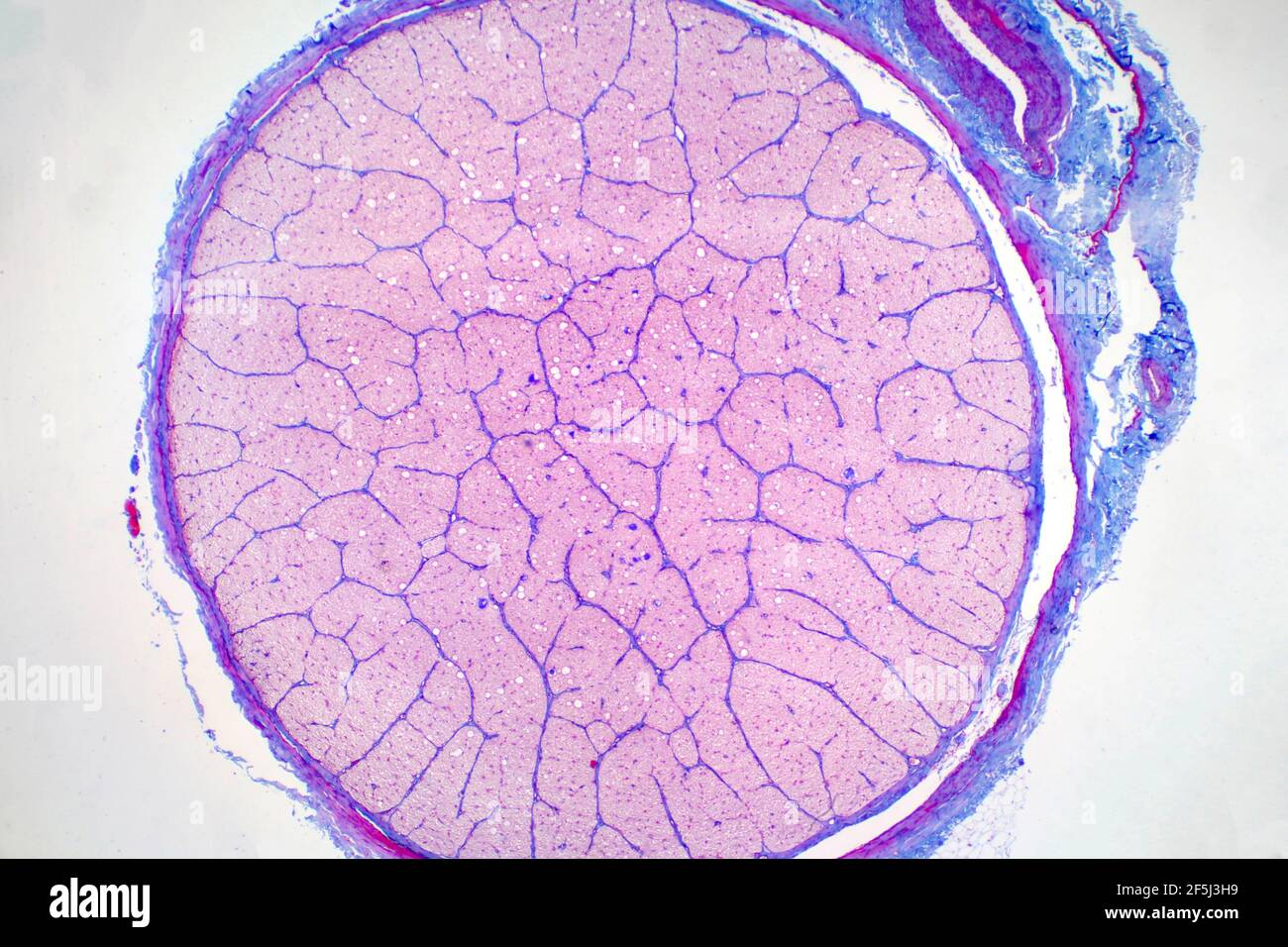 Nervio optico anatomia immagini e fotografie stock ad alta risoluzione ...
