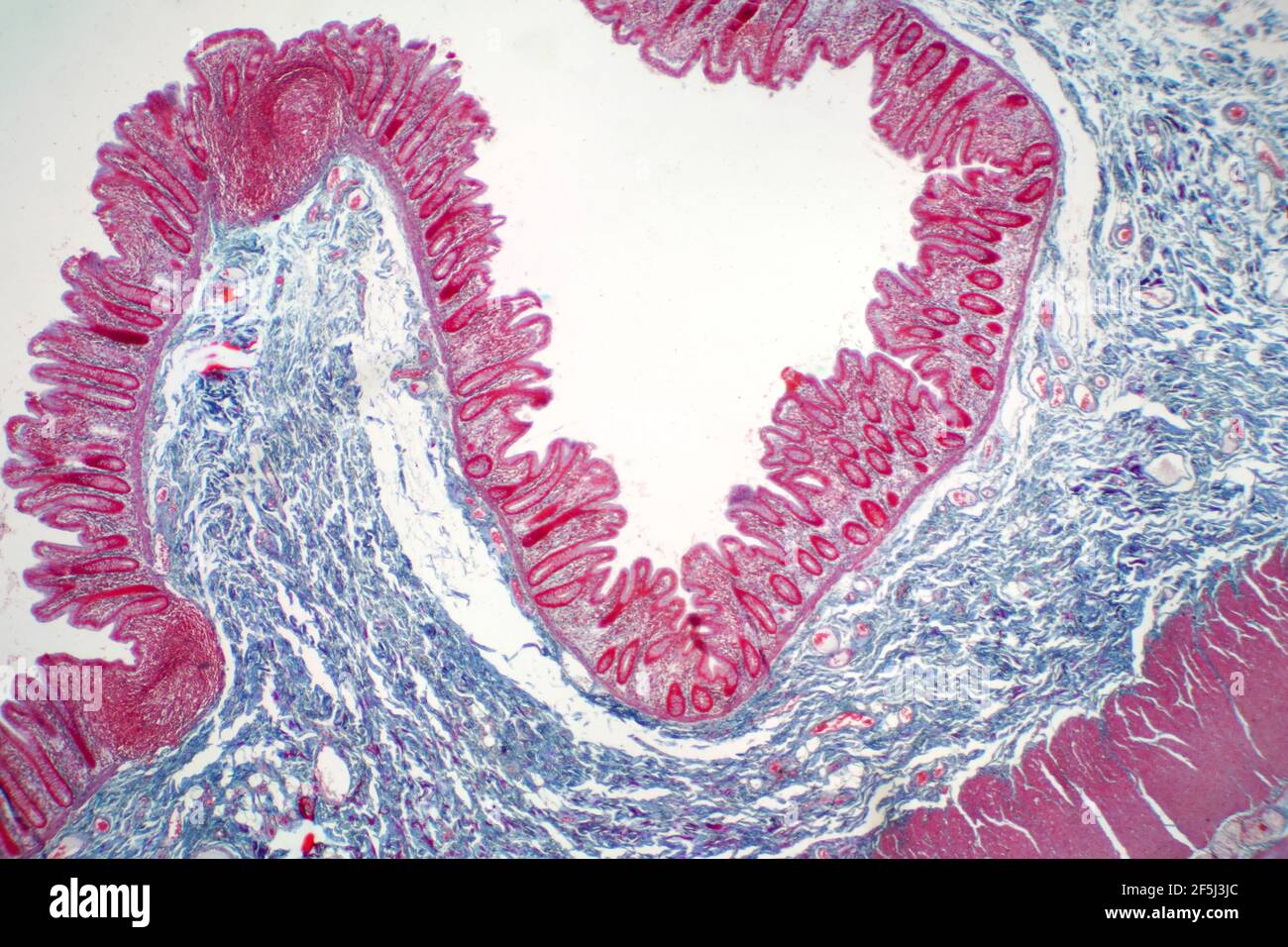 Intestino crasso microscopia immagini e fotografie stock ad alta ...