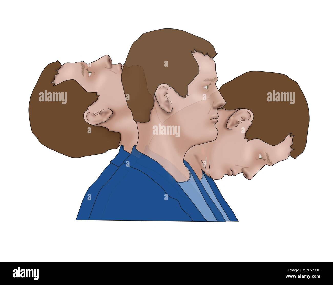 Colpo di frusta della vertebra immagini e fotografie stock ad alta ...