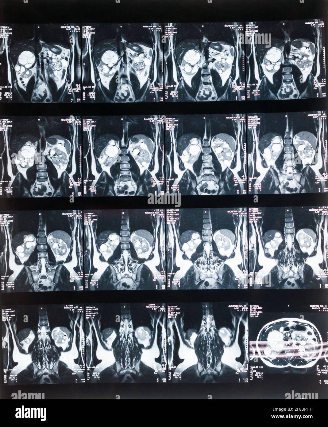 Imaging di risonanza magnetica, MRI, tomografia computerizzata ... Imaging di risonanza magnetica, MRI, tomografia computerizzata ...