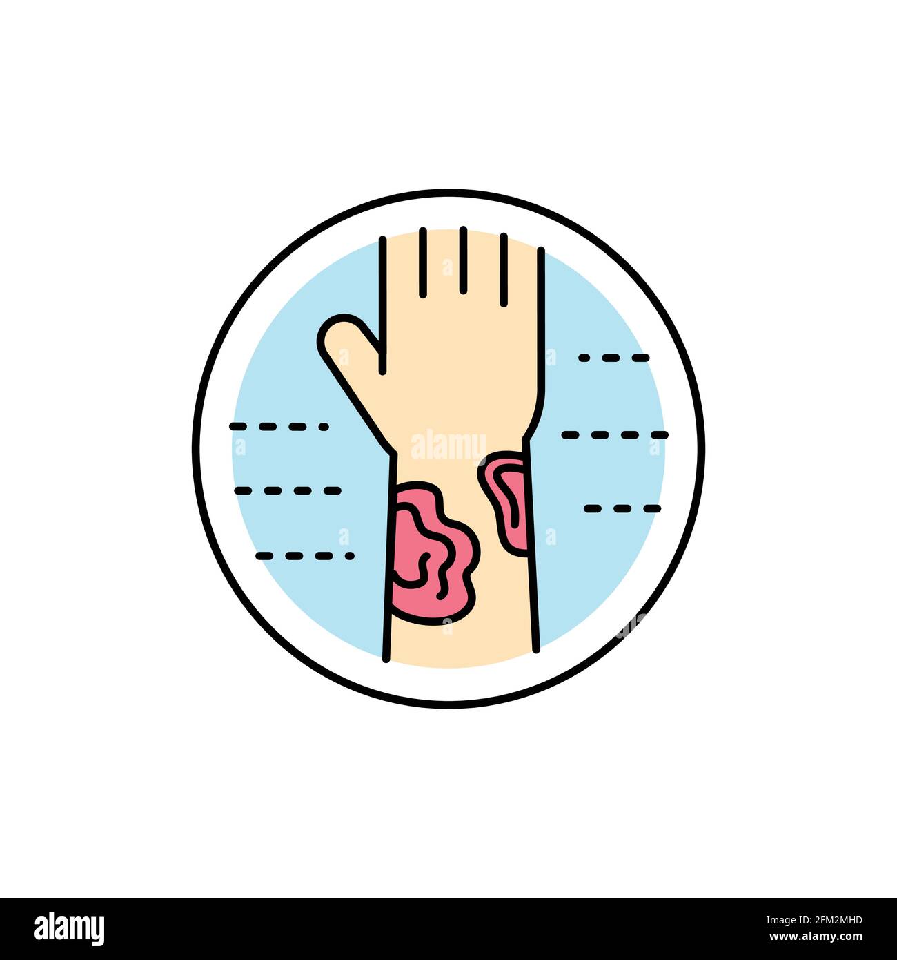 Lichen planus immagini e fotografie stock ad alta risoluzione - Alamy