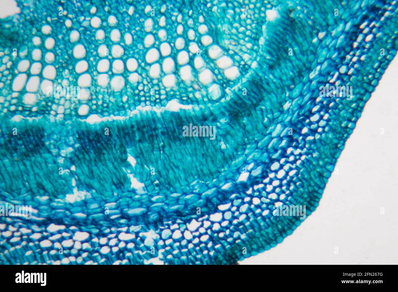 Sezione arteria microscopio immagini e fotografie stock ad alta ...