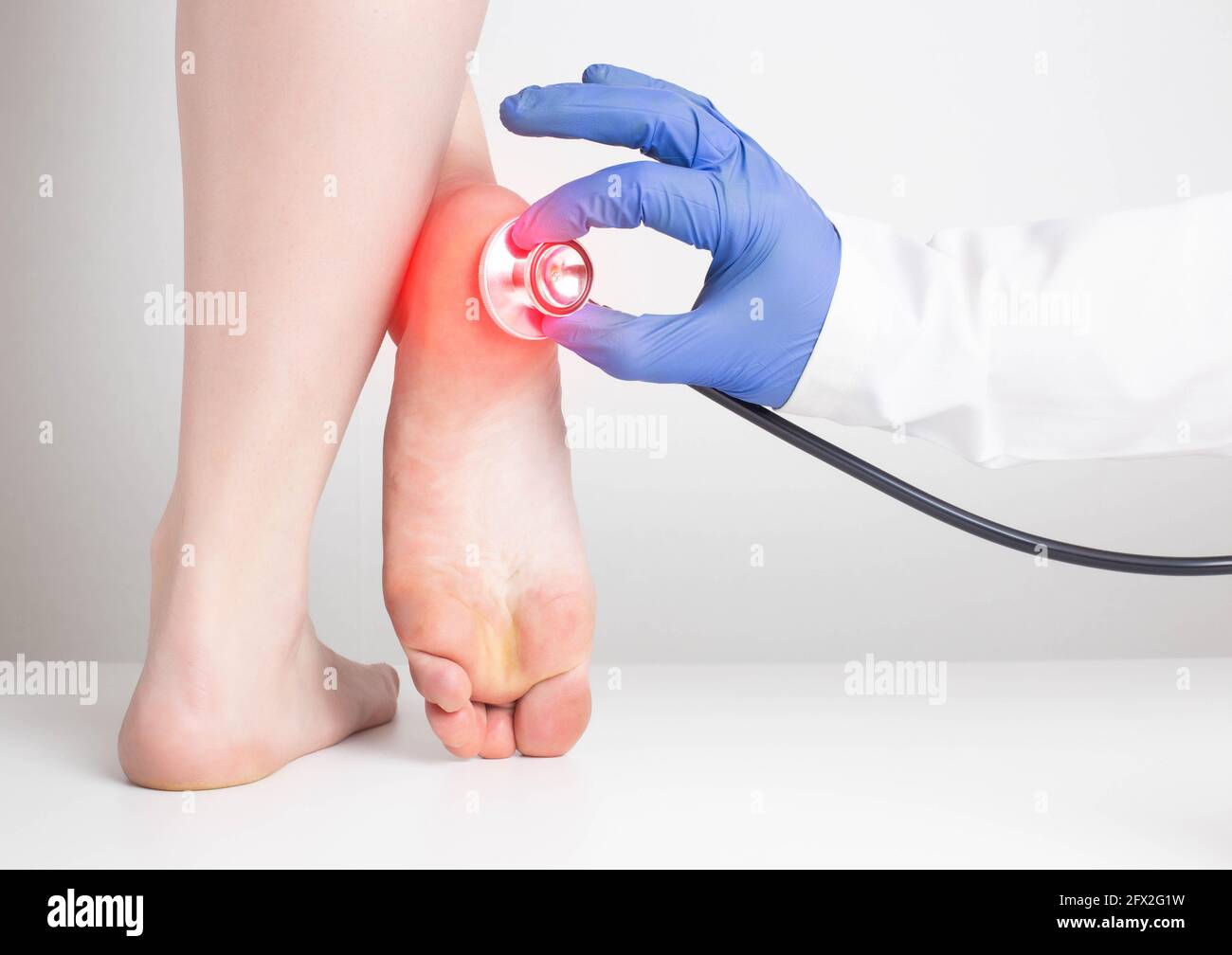 Sindrome del piede diabetico immagini e fotografie stock ad alta ...