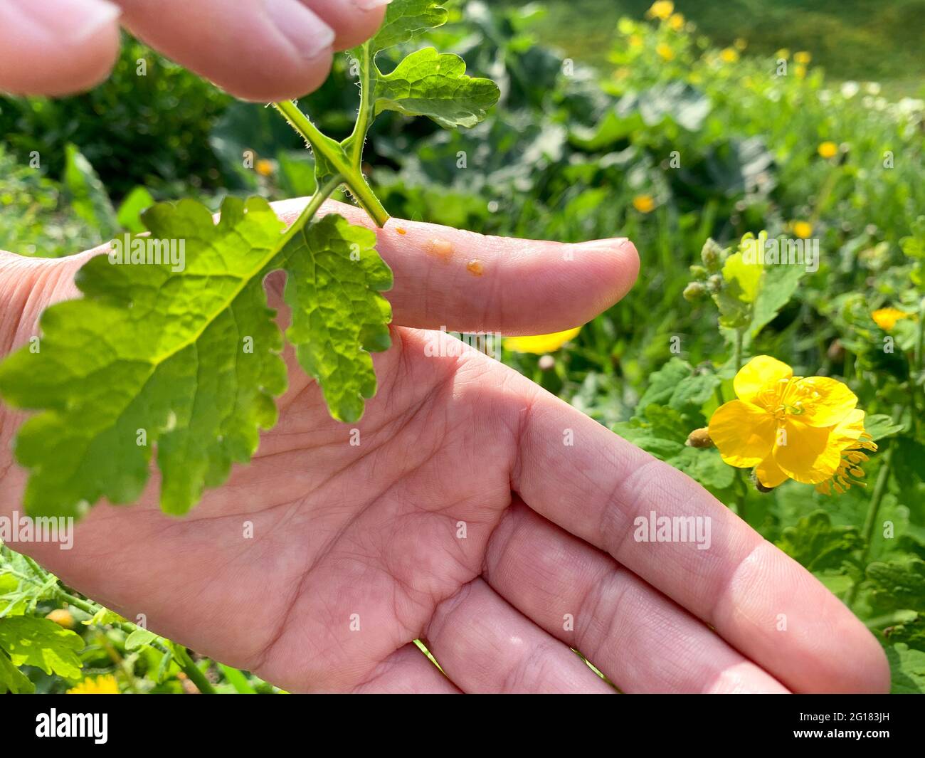 Rimedio per le verruche immagini e fotografie stock ad alta risoluzione ...