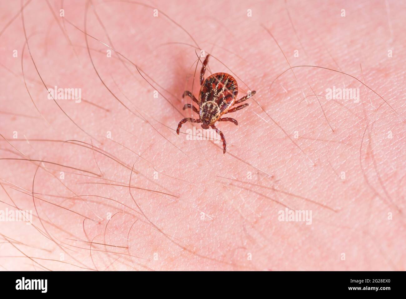 Morso di zecca immagini e fotografie stock ad alta risoluzione - Alamy