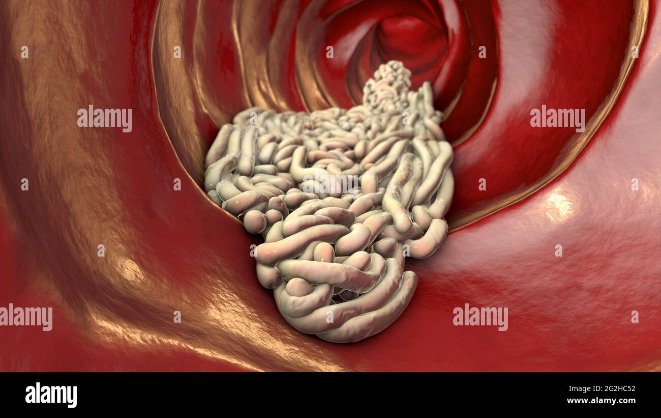 Nematode nematode enterobio immagini e fotografie stock ad alta ...