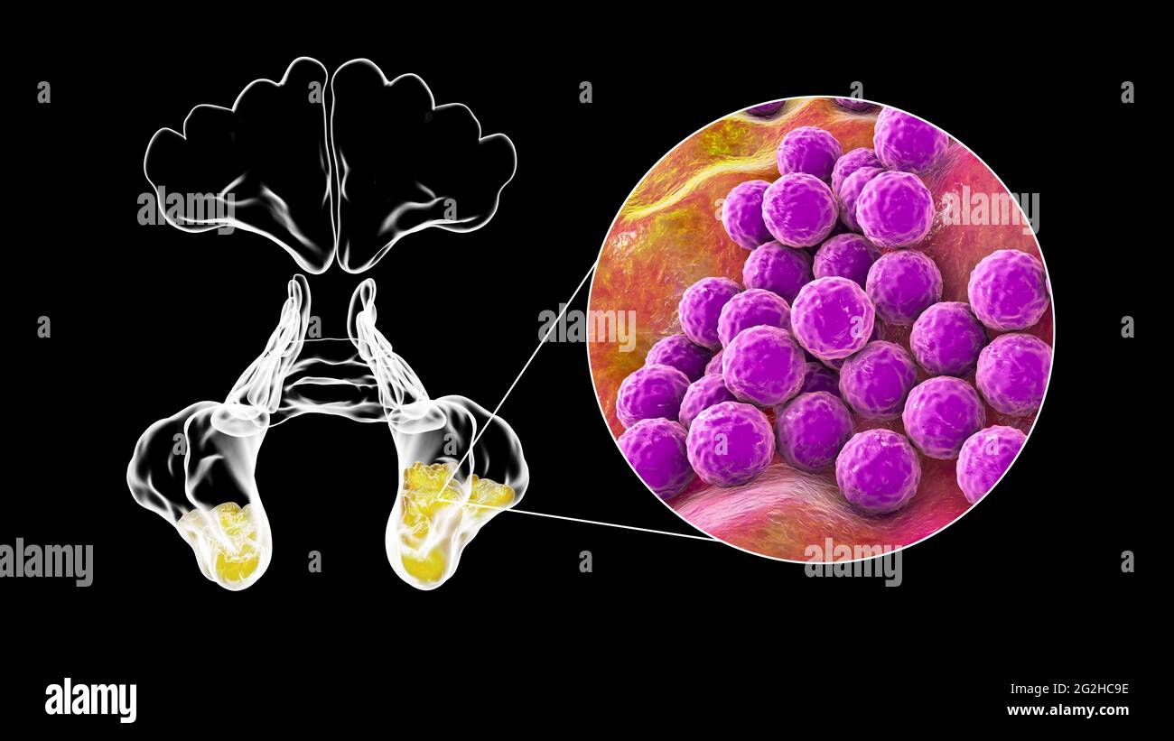 Frontal sinuses immagini e fotografie stock ad alta risoluzione - Alamy