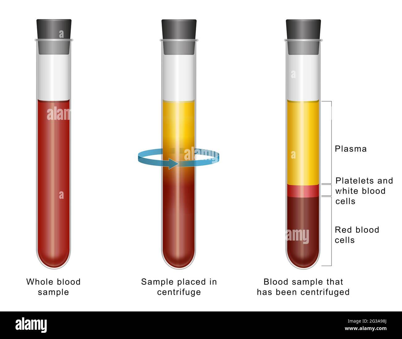 Componenti del sangue Immagini senza sfondo e Foto Stock ritagliate - Alamy