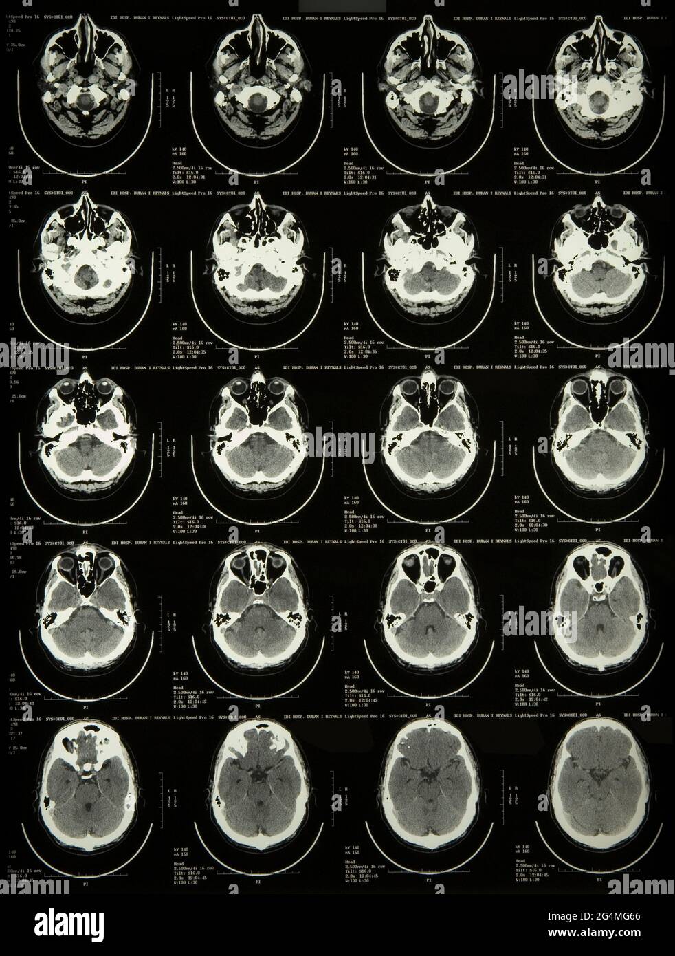Imaging mri nmr immagini e fotografie stock ad alta risoluzione - Alamy