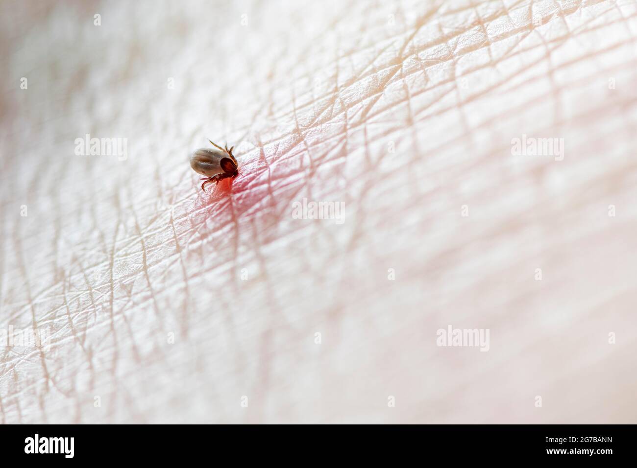 Morso di zecca immagini e fotografie stock ad alta risoluzione - Alamy