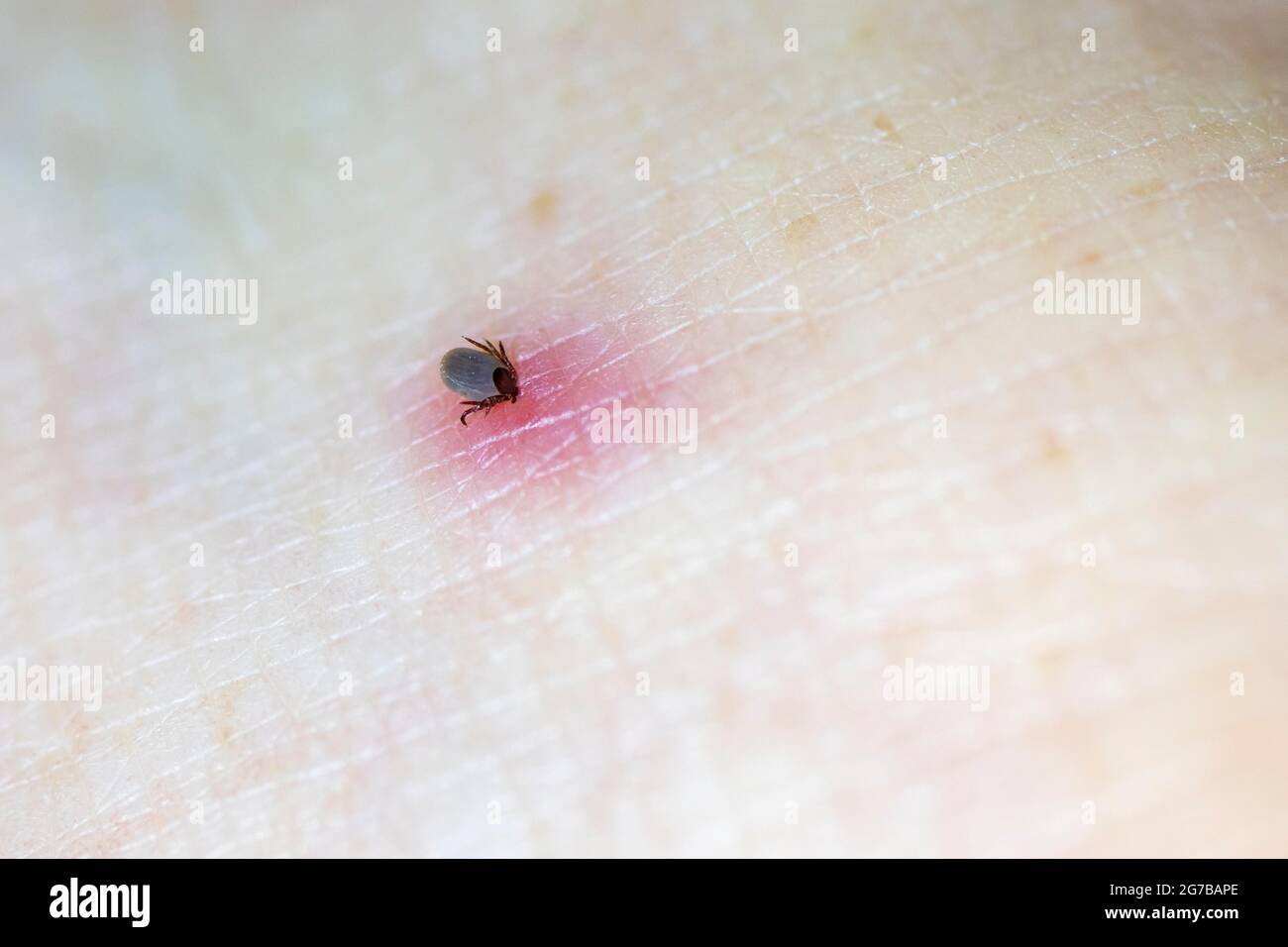Morso di zecca immagini e fotografie stock ad alta risoluzione - Alamy