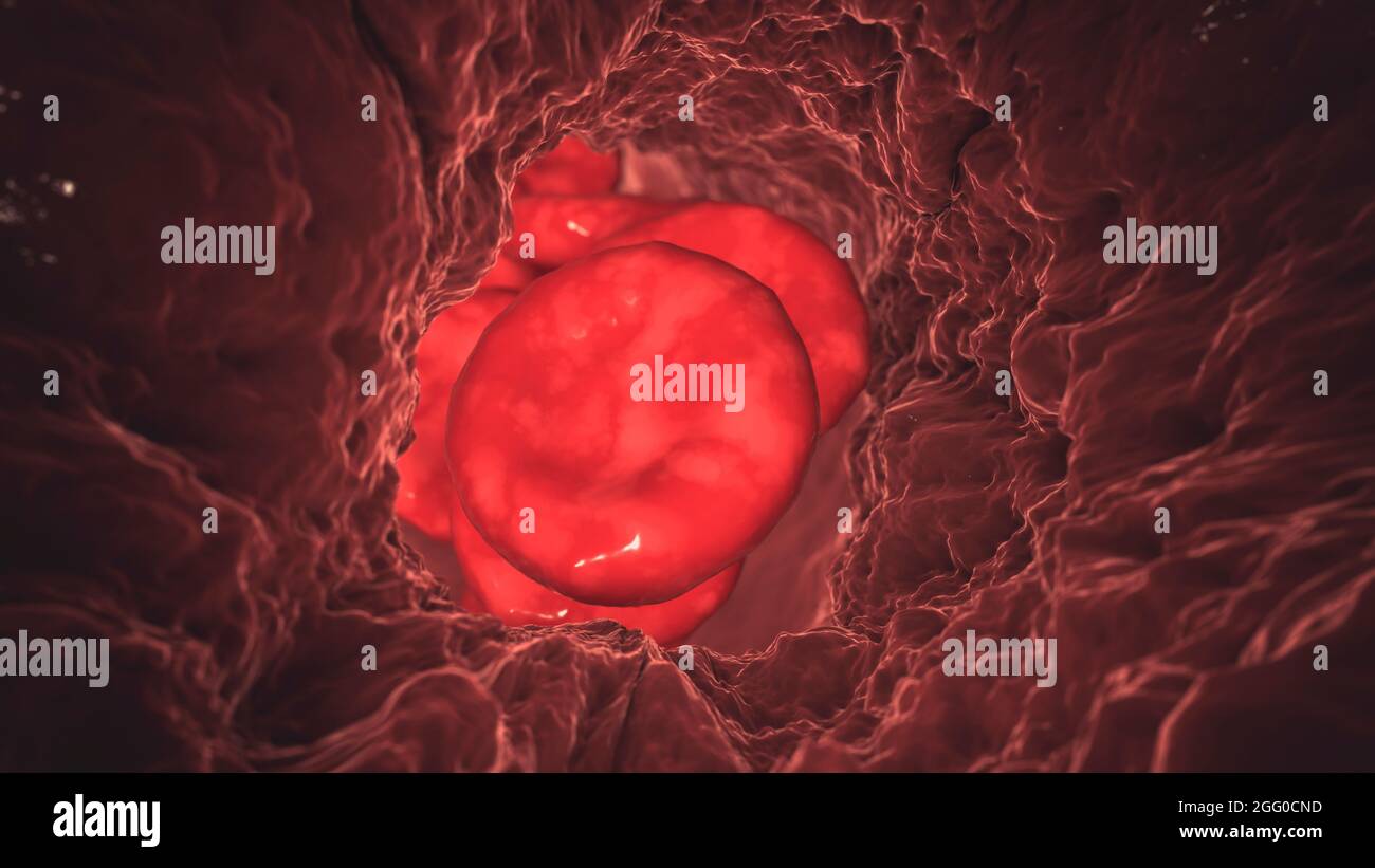 Rischio di coaguli di sangue da coronavirus immagini e fotografie stock ...