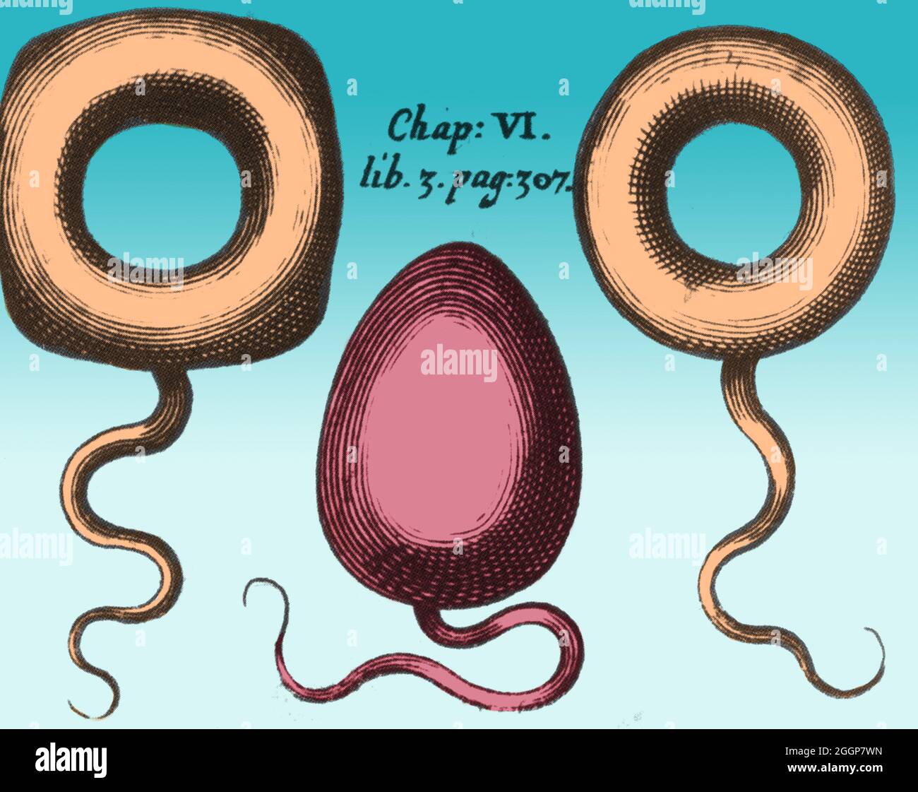 Prolasso dell'utero immagini e fotografie stock ad alta risoluzione - Alamy