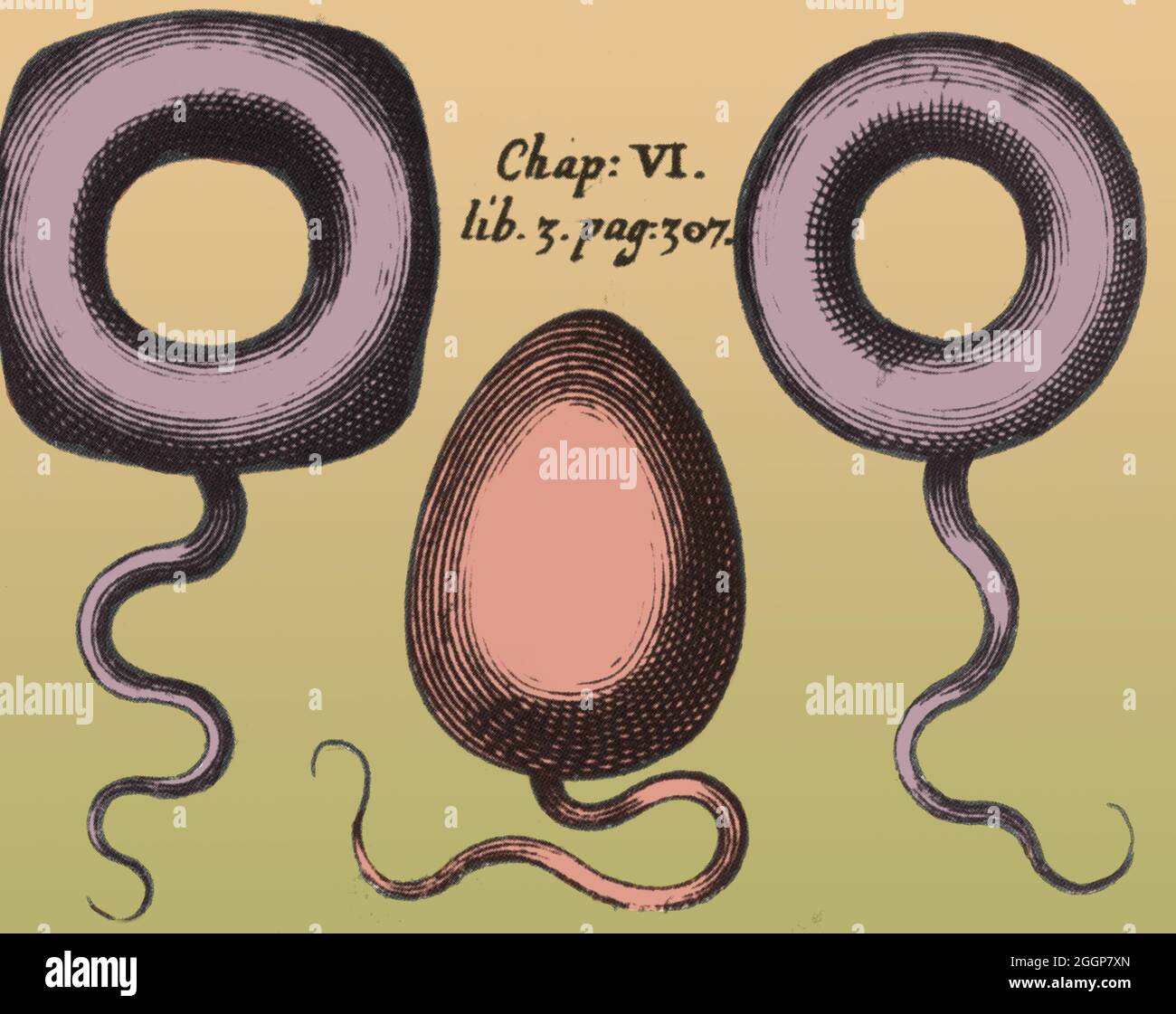 Prolasso uterino immagini e fotografie stock ad alta risoluzione - Alamy