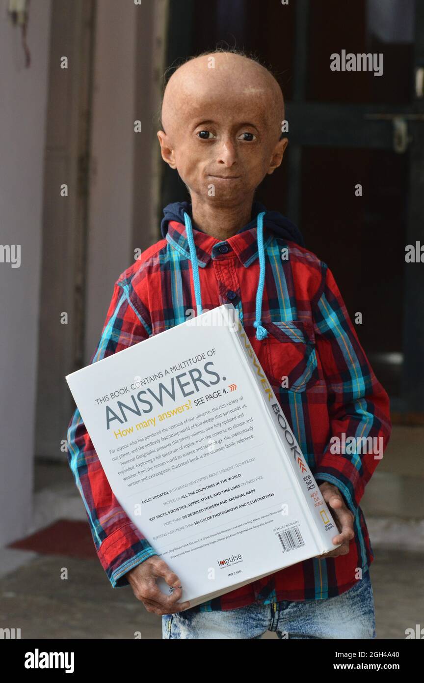 Sindrome di progeria immagini e fotografie stock ad alta risoluzione ...